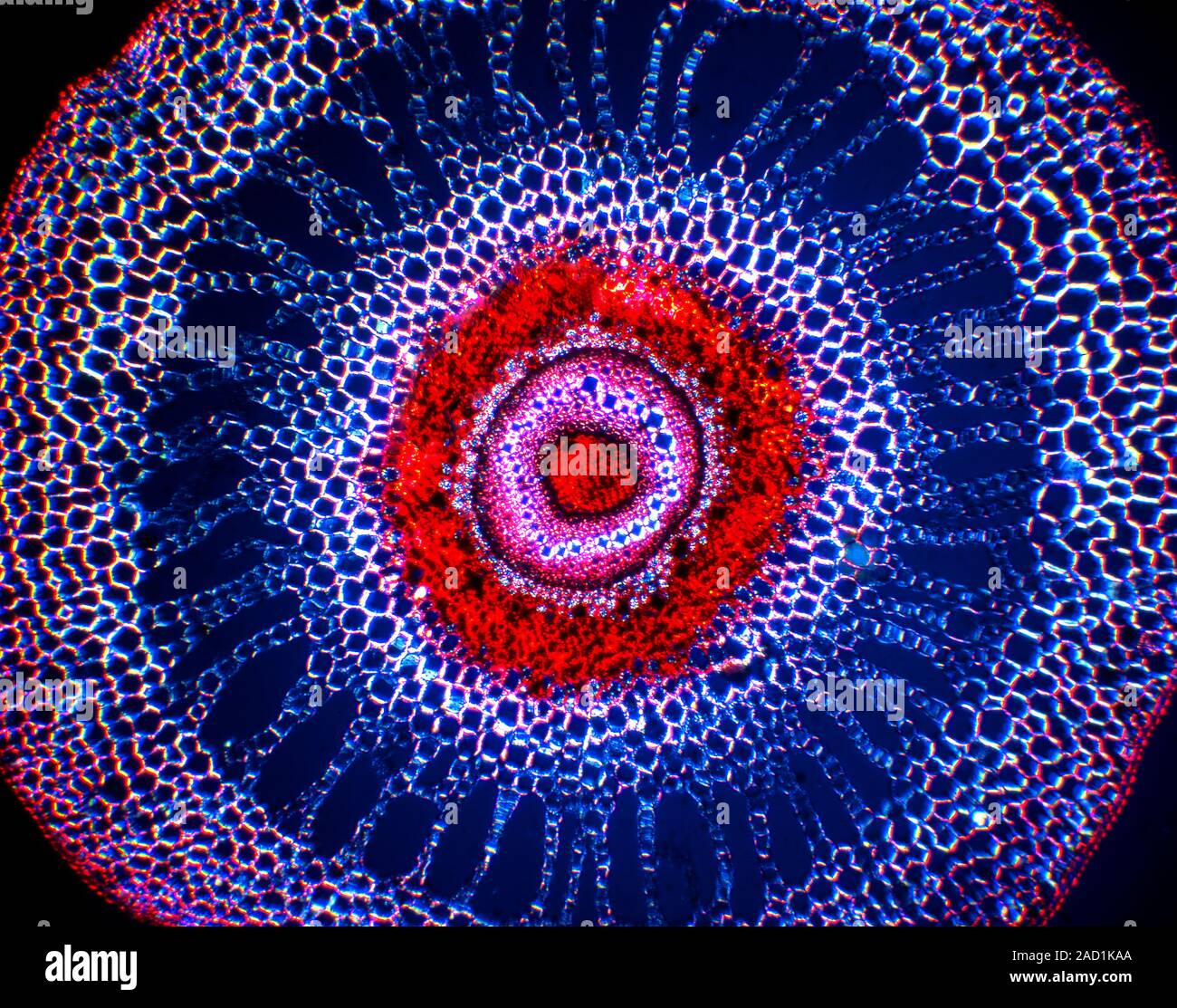 Fern (Marsilea quadrifolia) rhizome. Light micrograph of a section ...