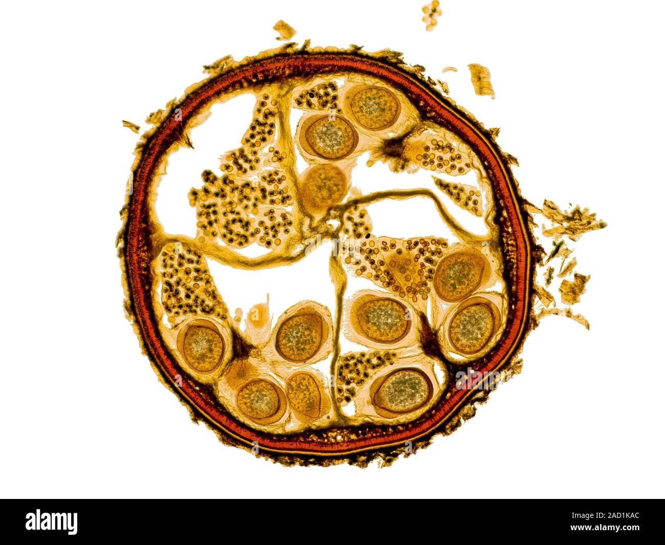 Fern (Pilularia sp.) sporocarp. Light micrograph of a section through a ...