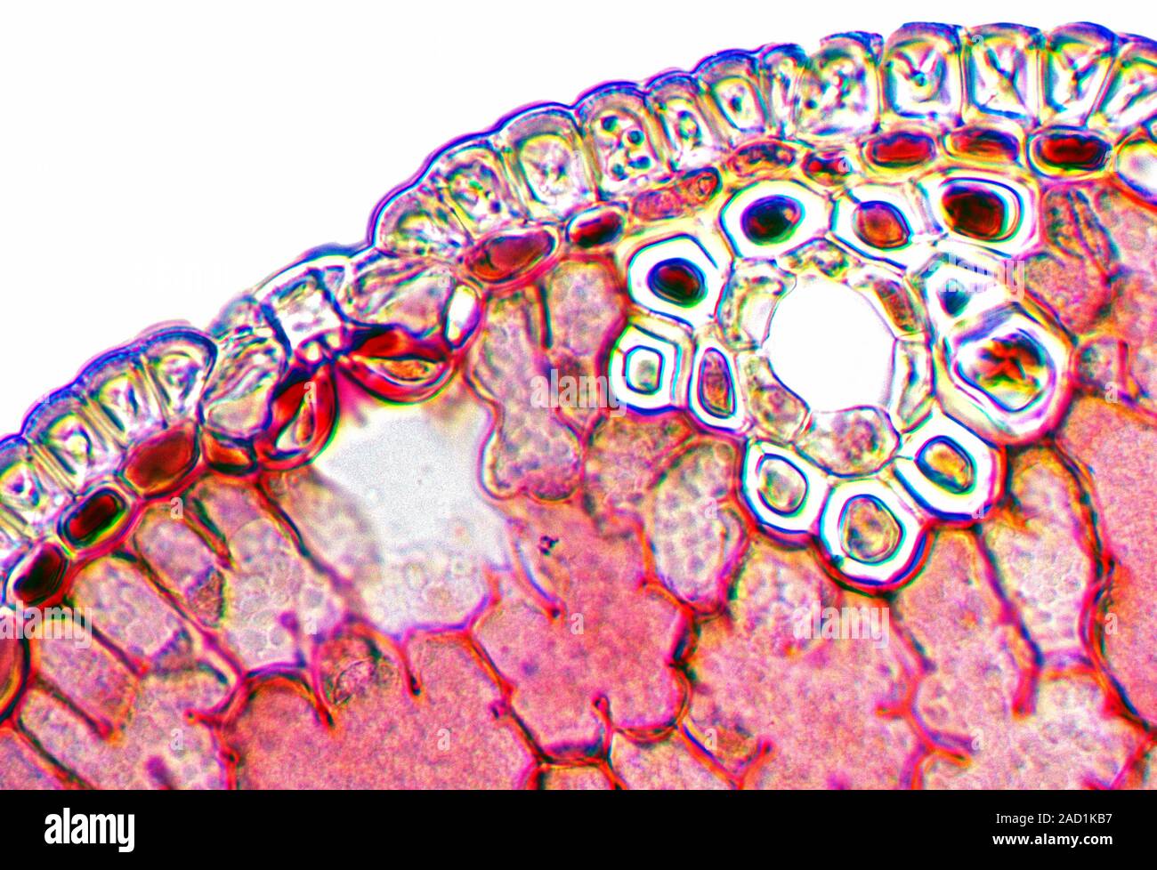 Scots pine (Pinus sylvestris) leaf. Light micrograph of a section ...