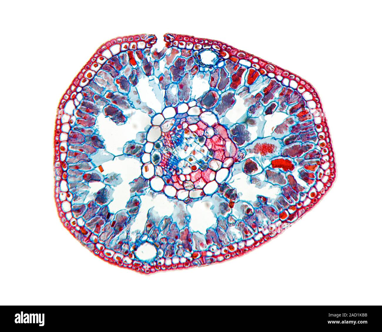 Himalayan cedar (Cedrus deodara) leaf. Light micrograph of a section ...