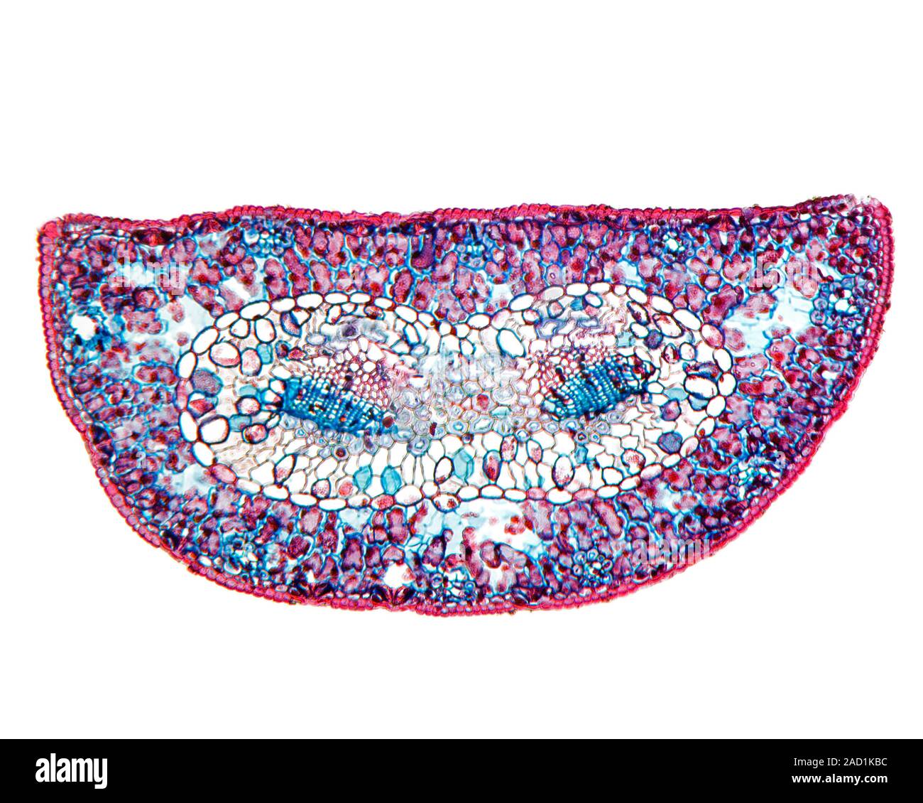 Scots pine (Pinus sylvestris) leaf. Light micrograph of a section ...