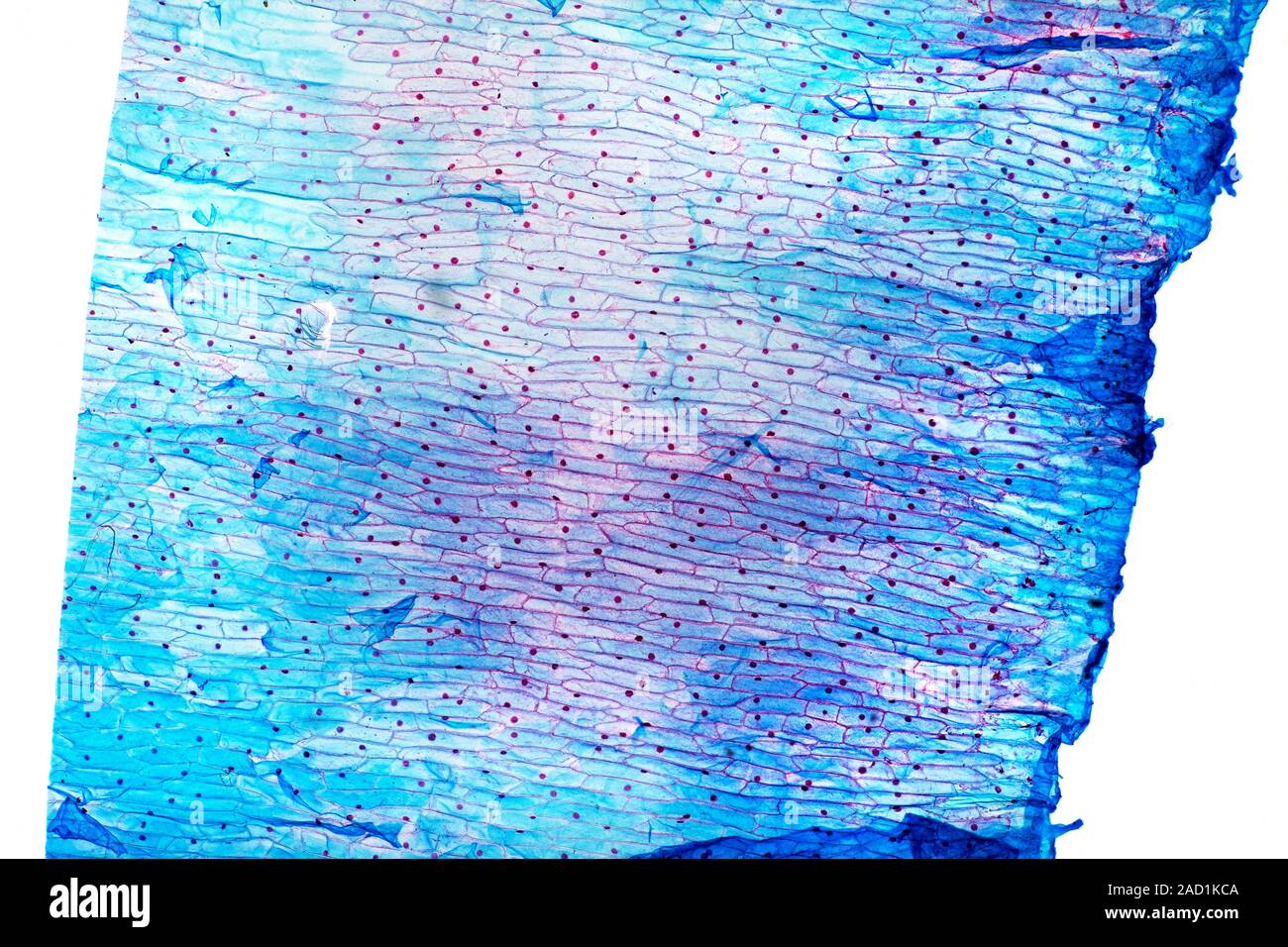 Leek skin. Light micrograph of a section through the epidermis of a ...