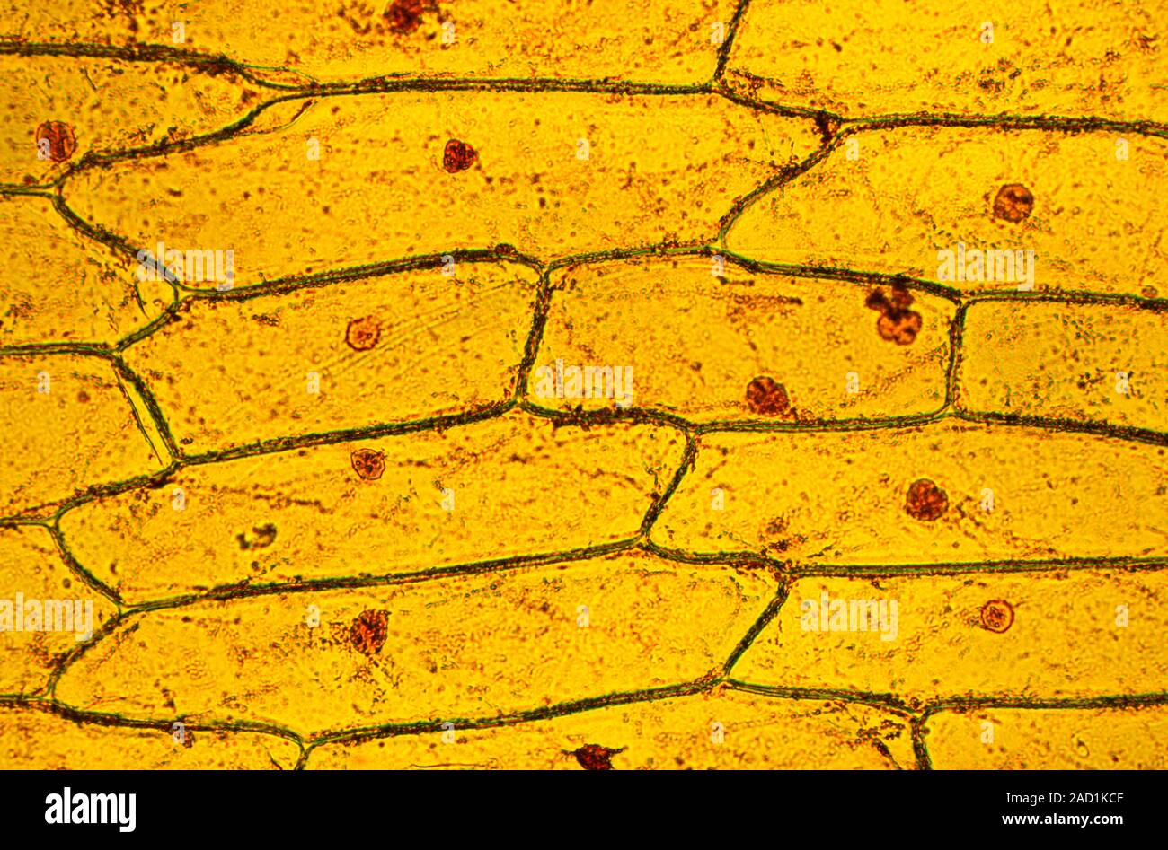 Leek skin. Light micrograph of a section through the epidermis of a ...