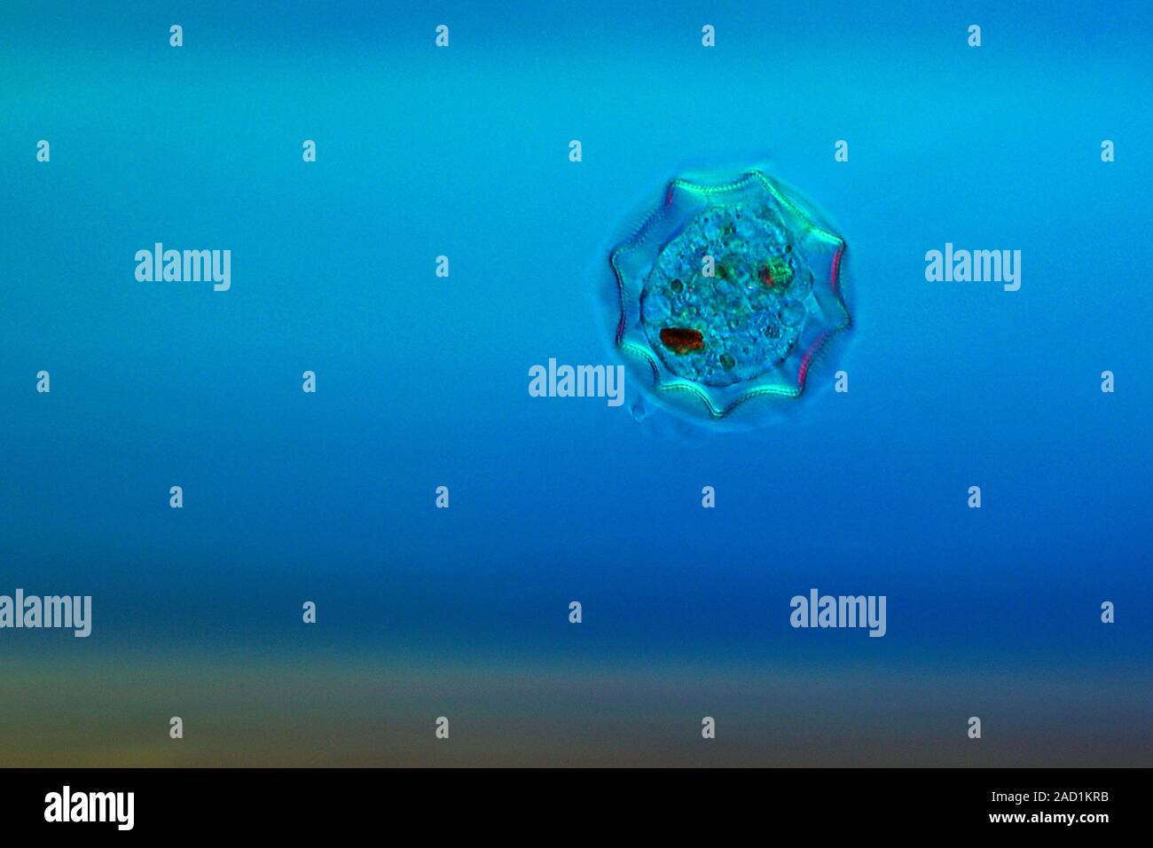 Shelled amoeba. Polarised light micrograph of an Arcella sp. testate ...