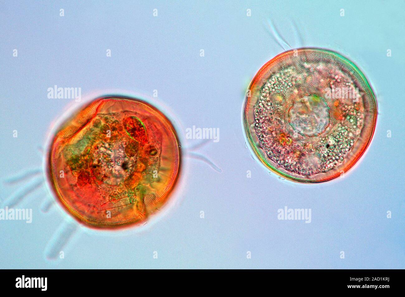 Shelled amoeba. Polarised light micrograph of two Arcella sp. testate ...