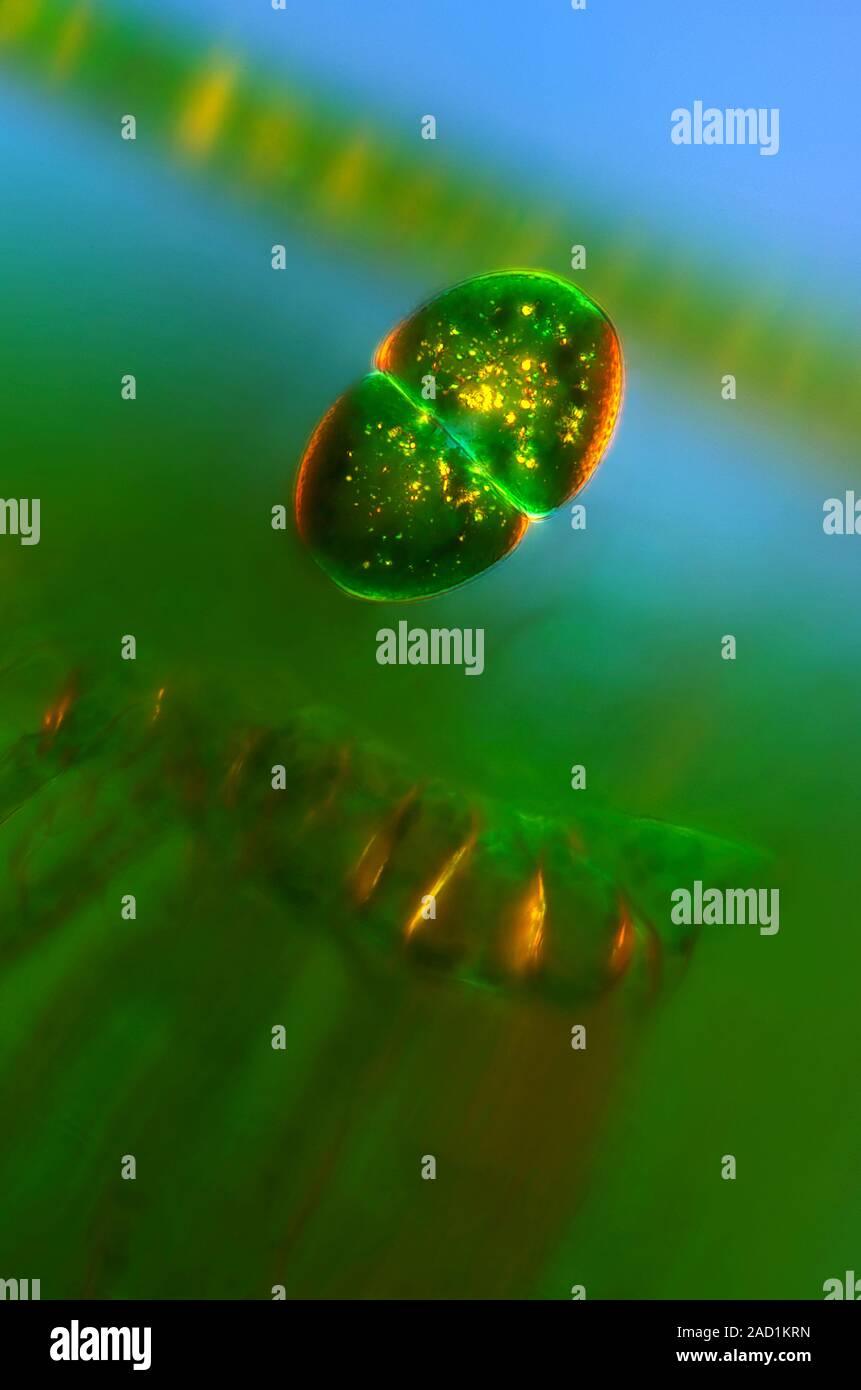 Cosmarium desmid. Polarised light micrograph of a Cosmarium sp. desmid ...