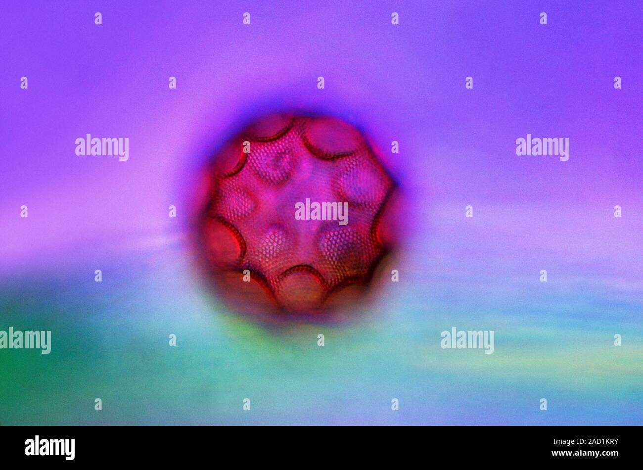 Shelled amoeba. Polarised light micrograph of an Arcella sp. testate ...