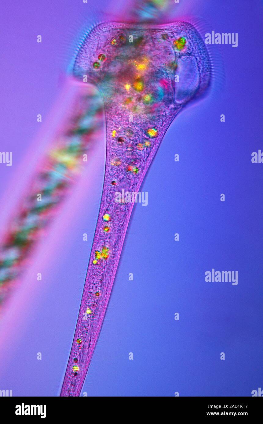 Stentor ciliate protozoan. Polarised light micrograph of a section ...
