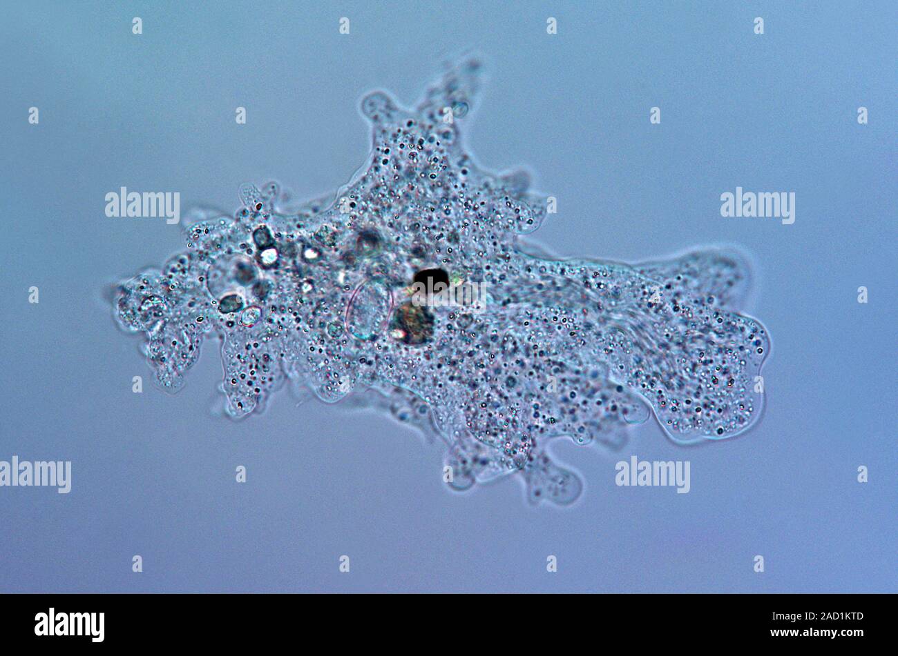 Amoeba protozoa. Polarised light micrograph of an Amoeba sp. protozoa, showing its internal ...