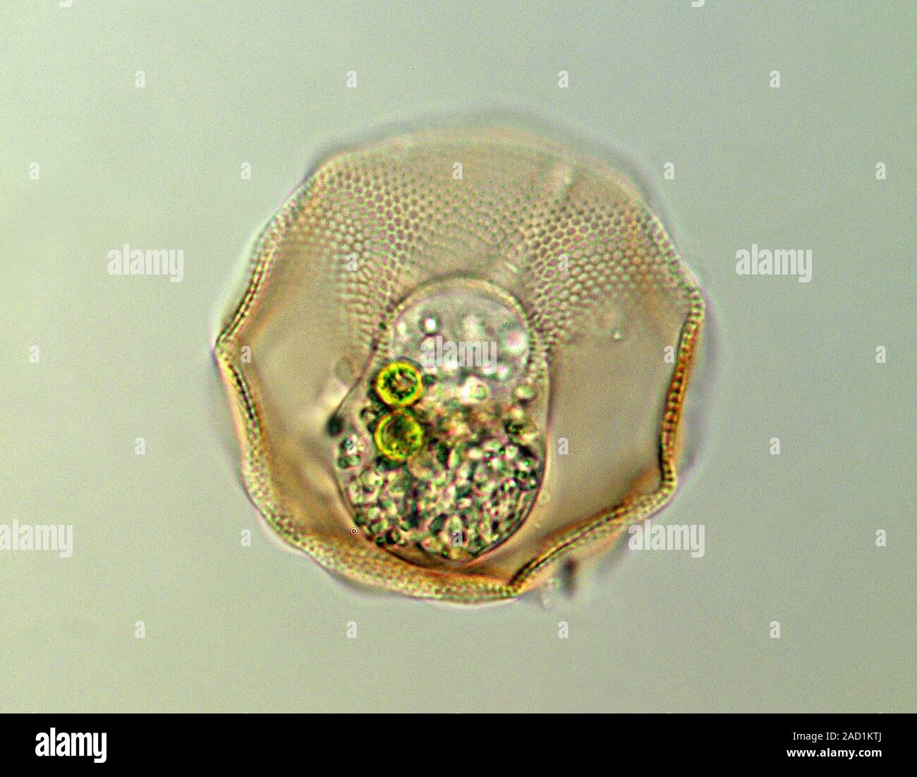 Shelled amoeba. Polarised light micrograph of an Arcella sp. testate ...