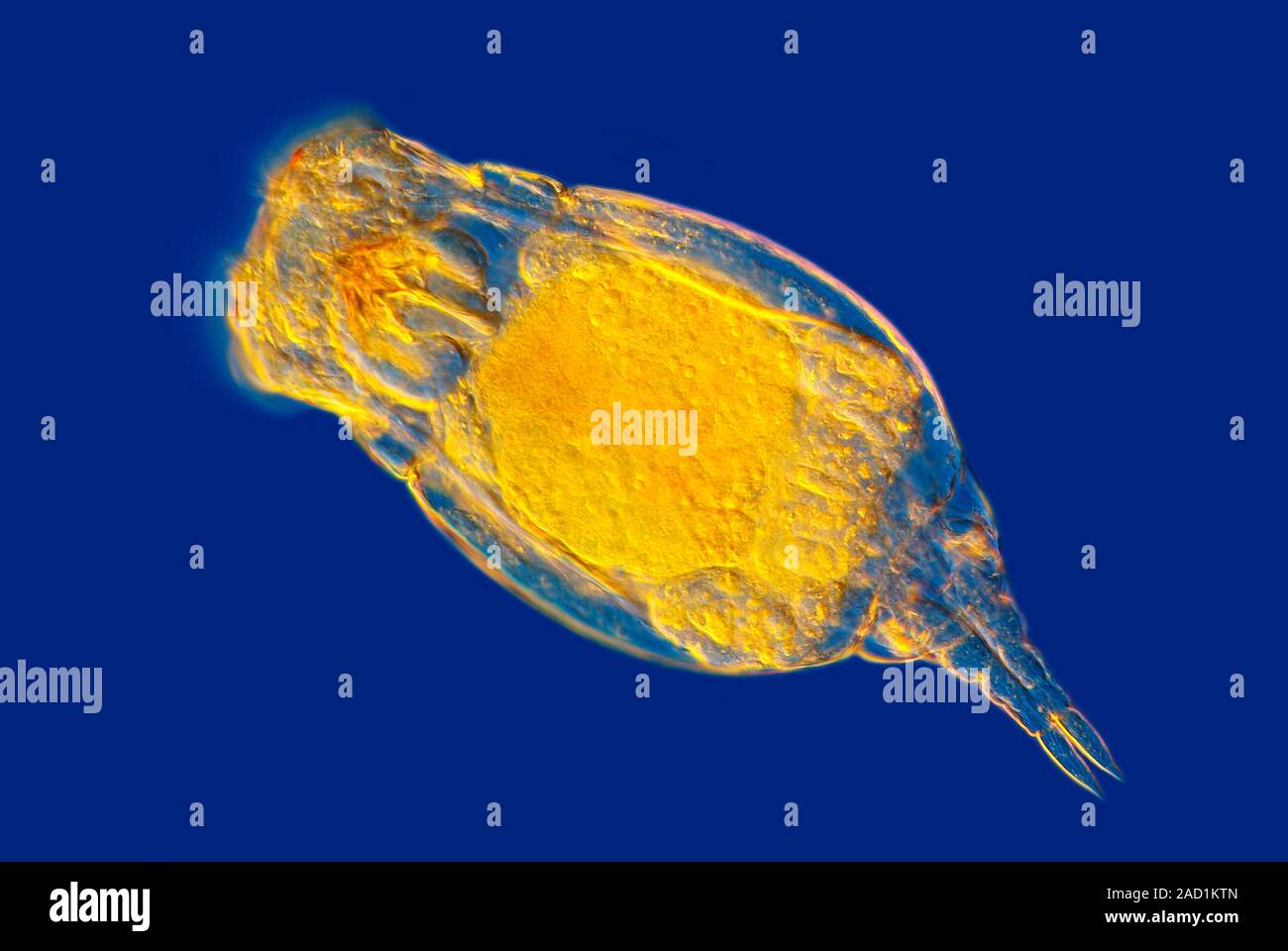 Rotifer. Rheinberg illuminated light micrograph of a rotifer (phylum ...