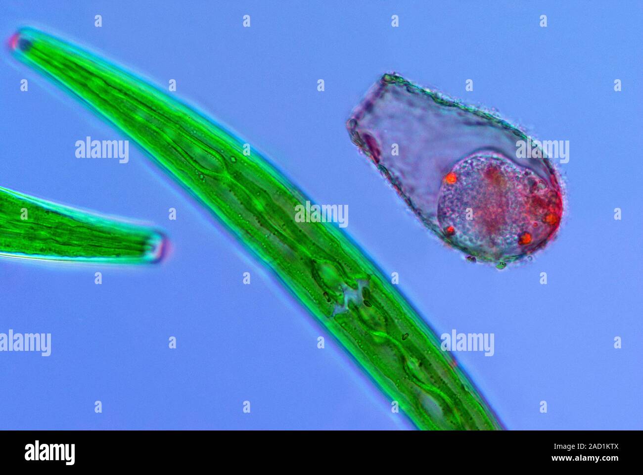 Amoeba and desmids. Polarised light micrograph of a Difflugia sp ...