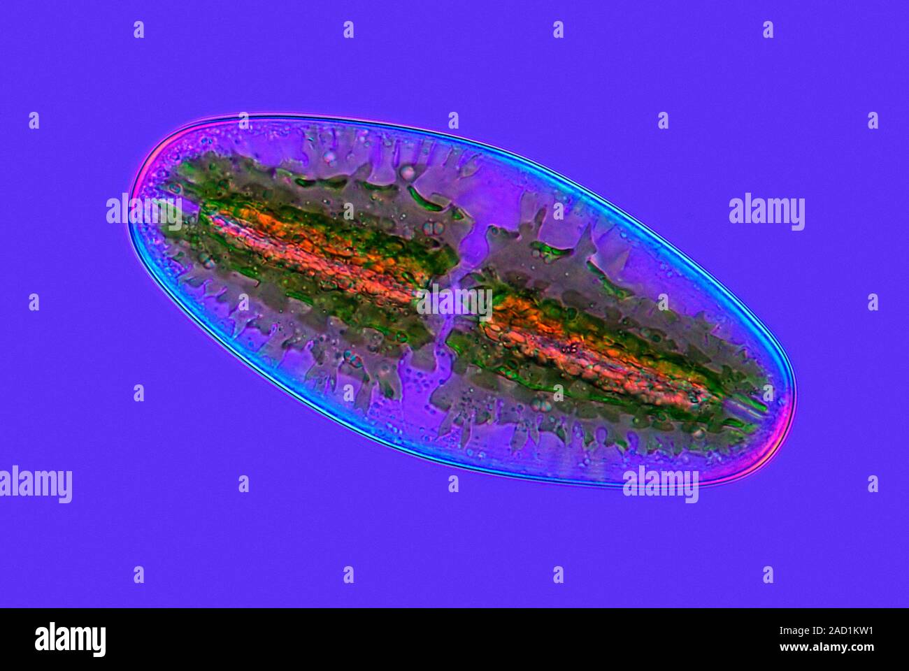 Netrium desmid. Polarised light micrograph of a Netrium sp. desmid ...