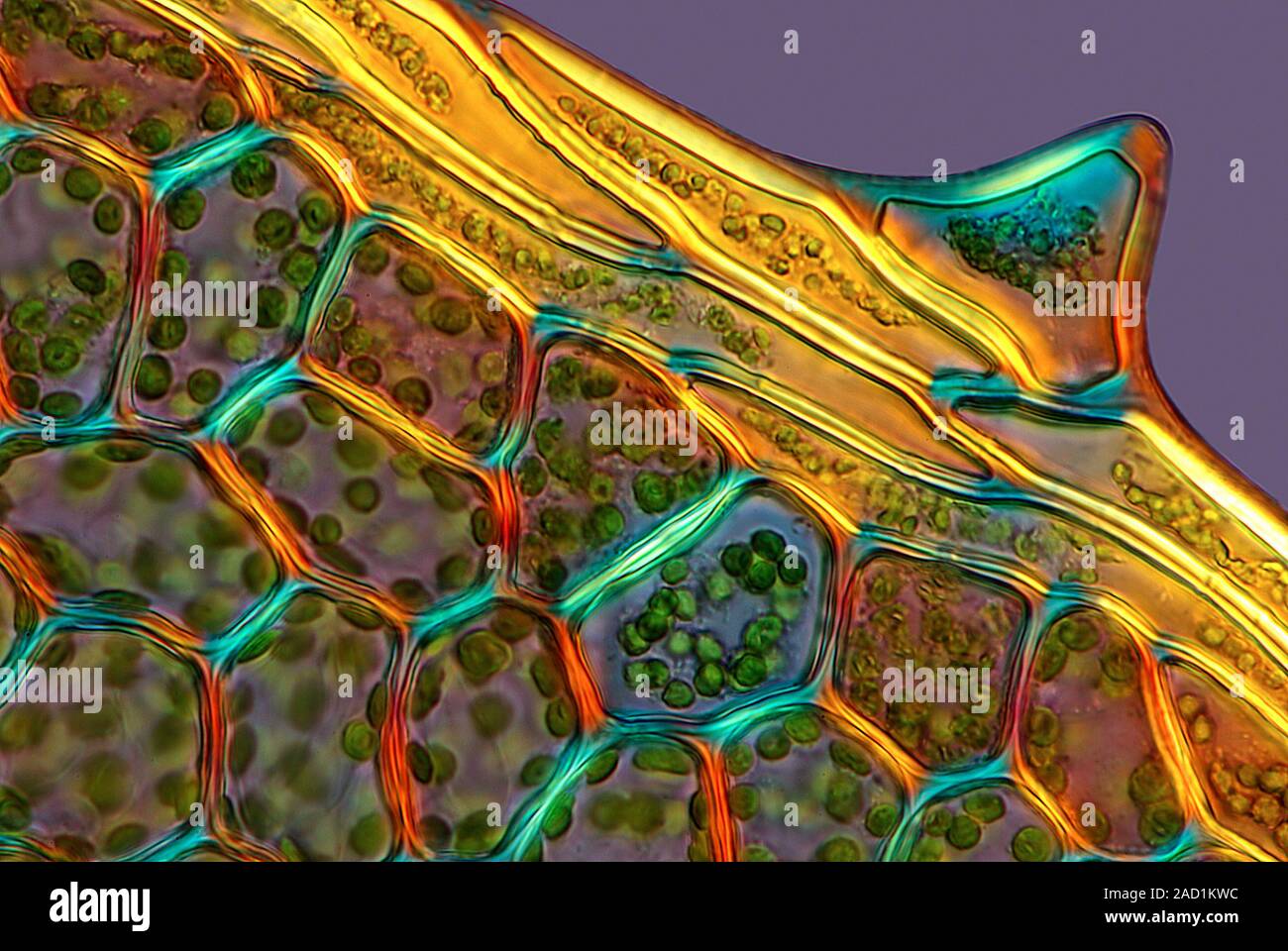 Moss. Polarised light micrograph of a section through moss tissue ...