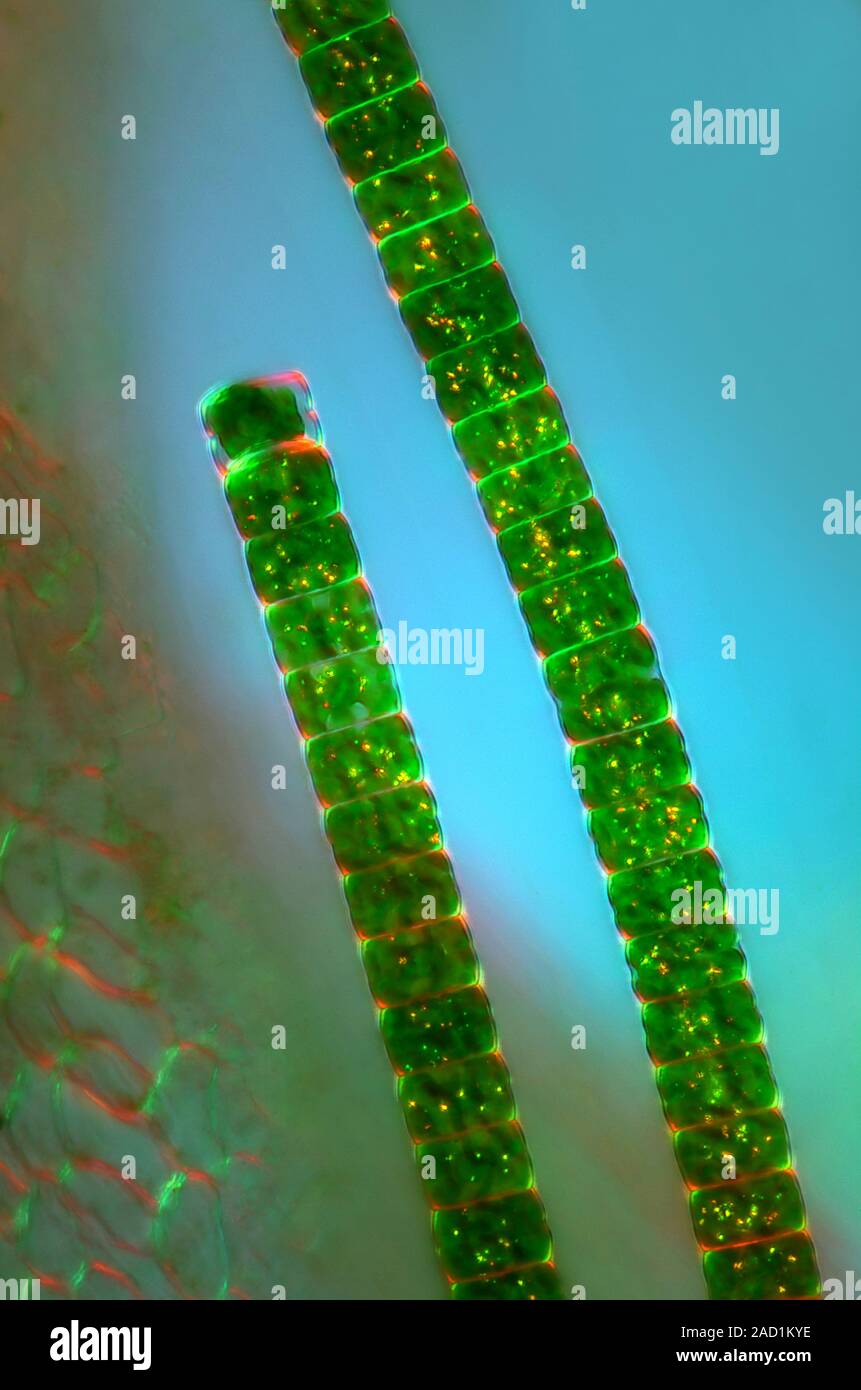Desmid on sphagnum moss. Polarised light micrograph of two Hyalotheca ...