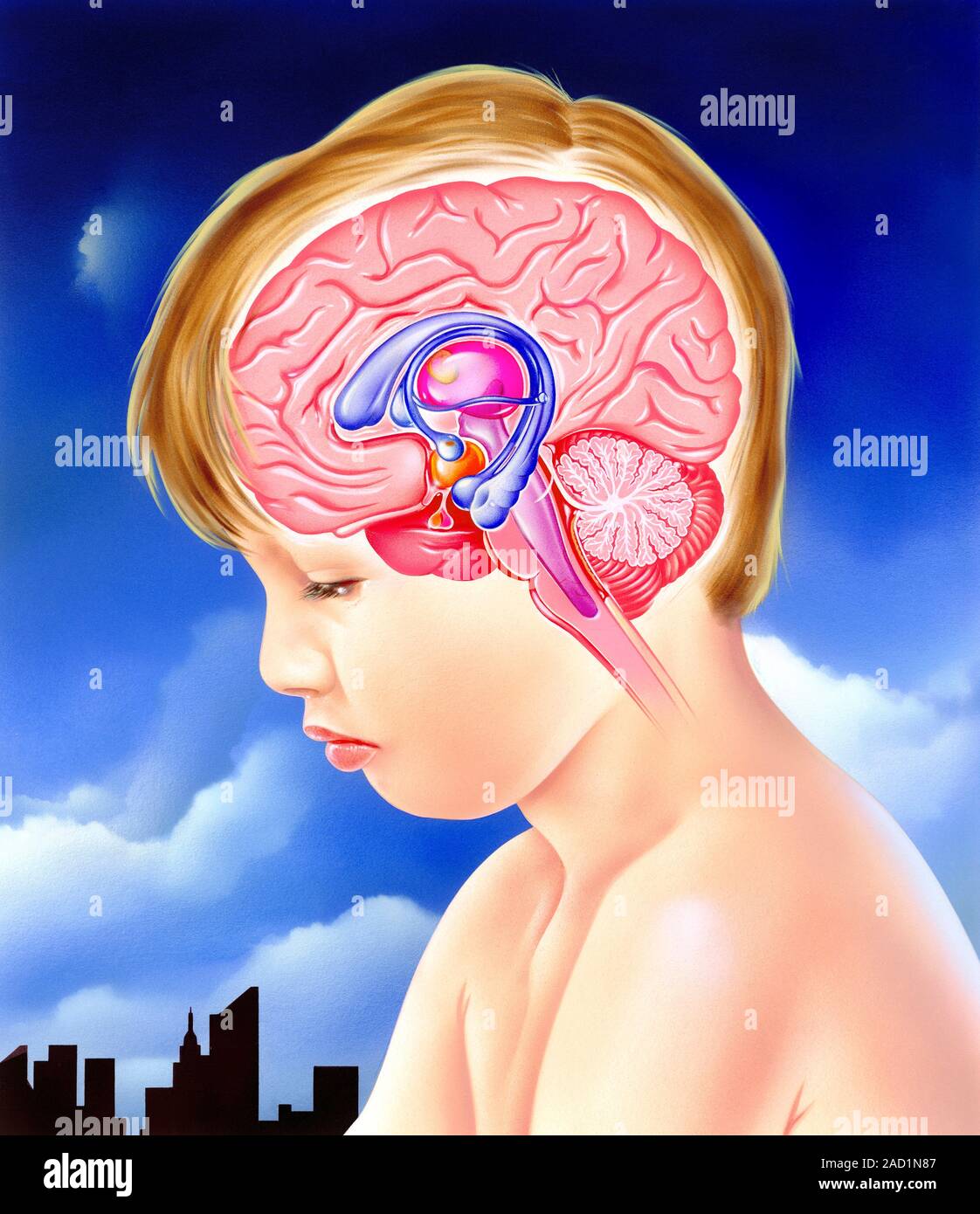 The brain and childhood depression. Illustration of the structures of ...