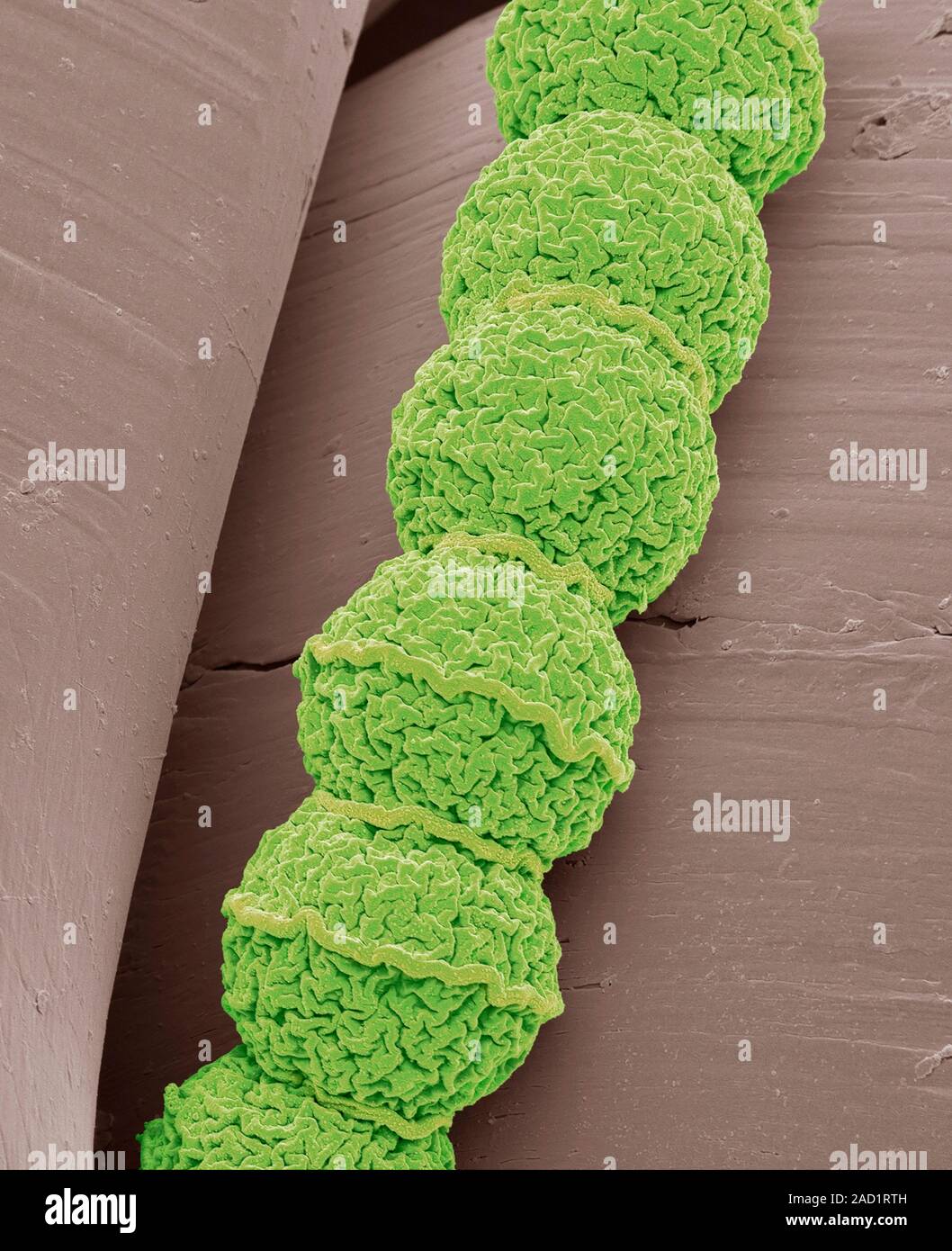 Anabaena algae. Coloured scanning electron micrograph (SEM) of Anabaena ...