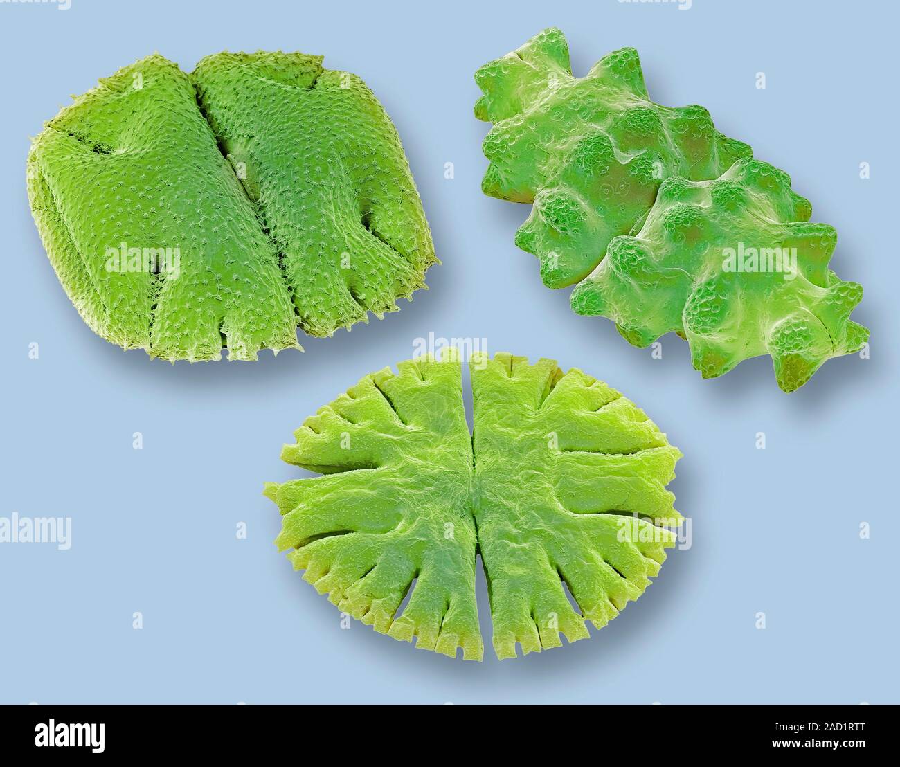 Desmid. Scanning electron micrograph (SEM) of three desmid green algae ...