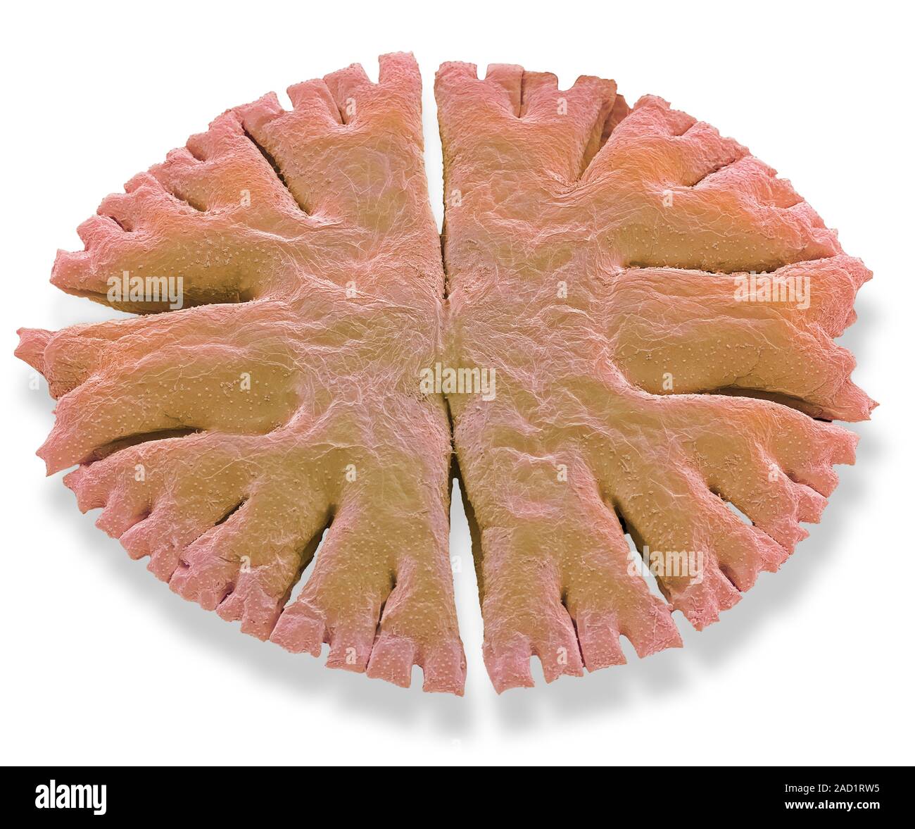 Micrasterias desmid. Scanning electron micrograph (SEM) of a ...
