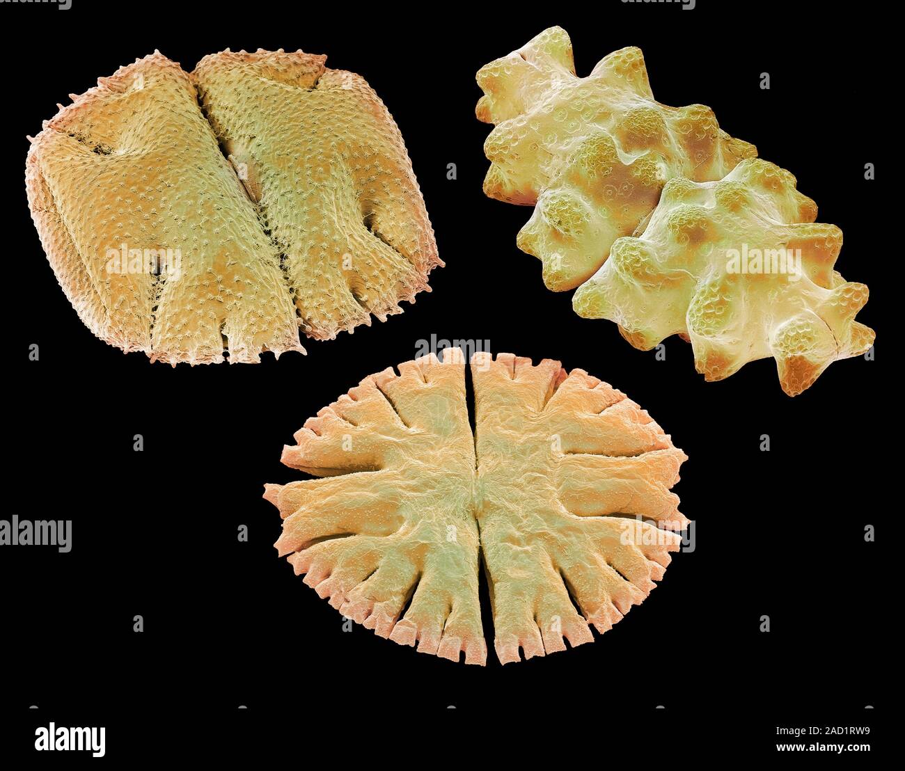 Desmid. Scanning electron micrograph (SEM) of three desmid green algae ...