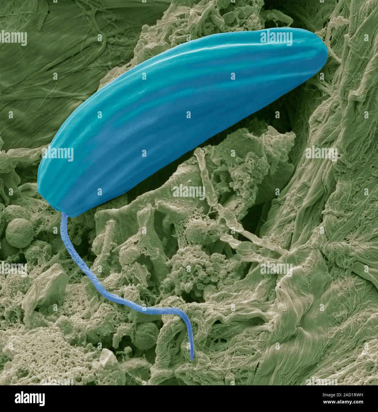 Flagellate protozoan, coloured scanning electron micrograph (SEM). This ...