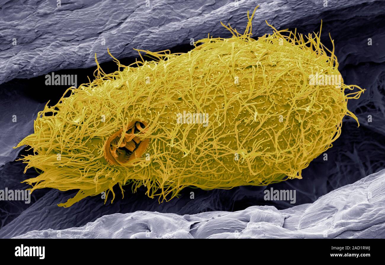 Colpidium ciliate protozoan. Coloured scanning electron micrograph (SEM ...