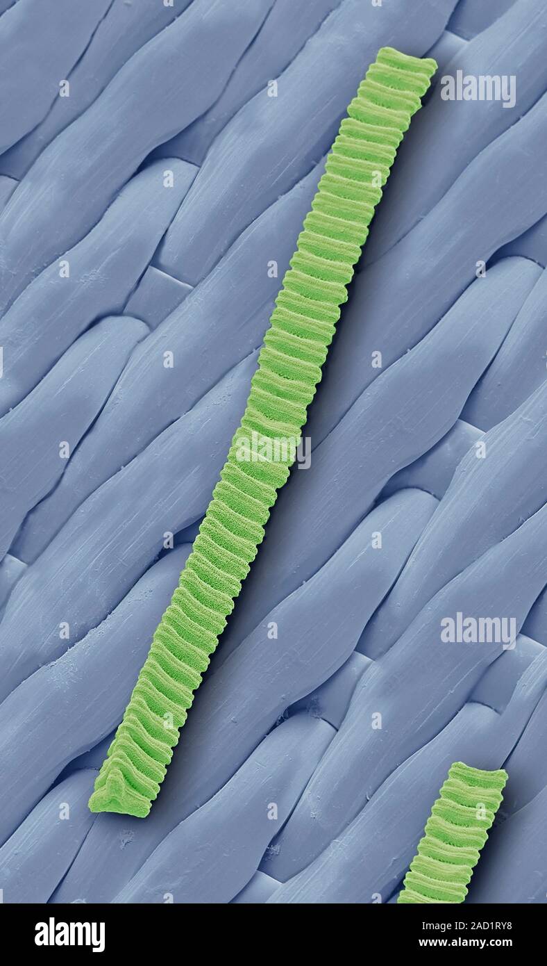 Desmidium desmid. Scanning electron micrograph (SEM) of a Desmidium ...