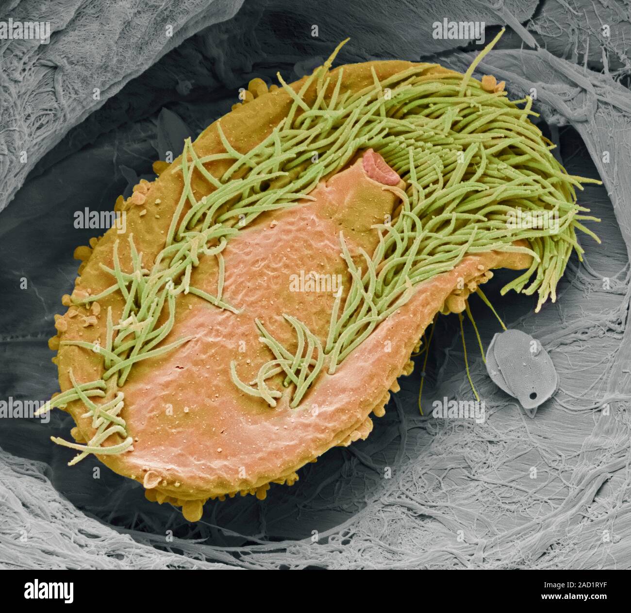 Freshwater ciliate protozoan. Scanning electron micrograph (SEM) of a ...