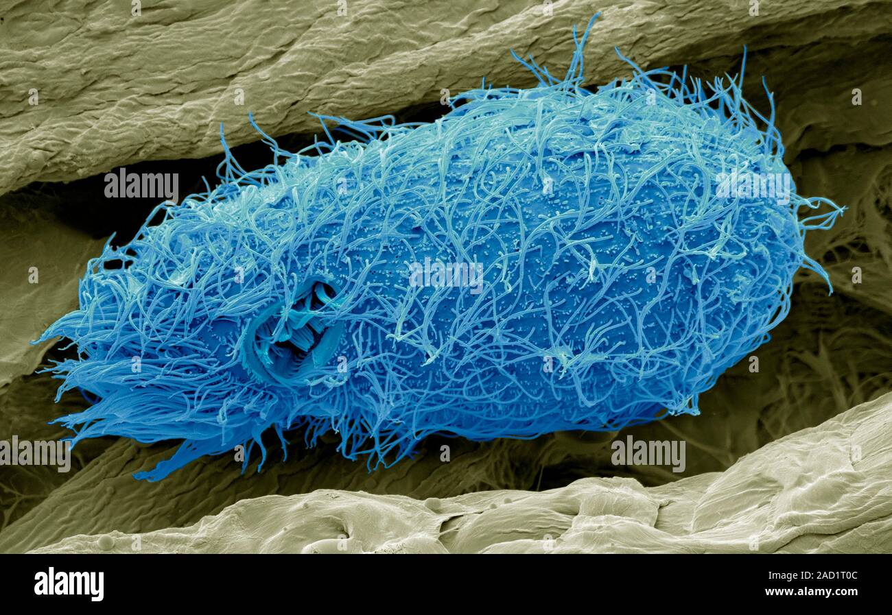 Colpidium ciliate protozoan. Coloured scanning electron micrograph (SEM ...