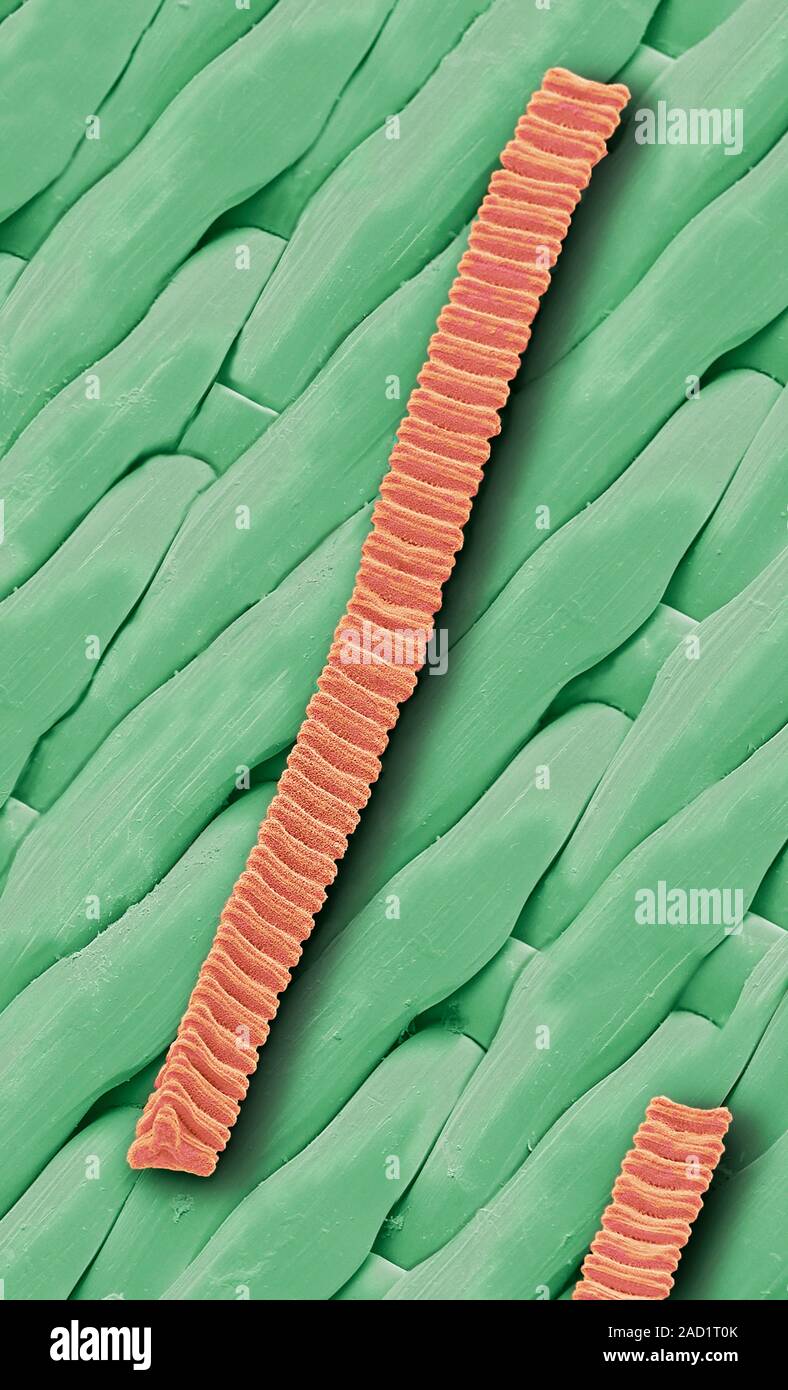 Desmidium desmid. Scanning electron micrograph (SEM) of a Desmidium ...