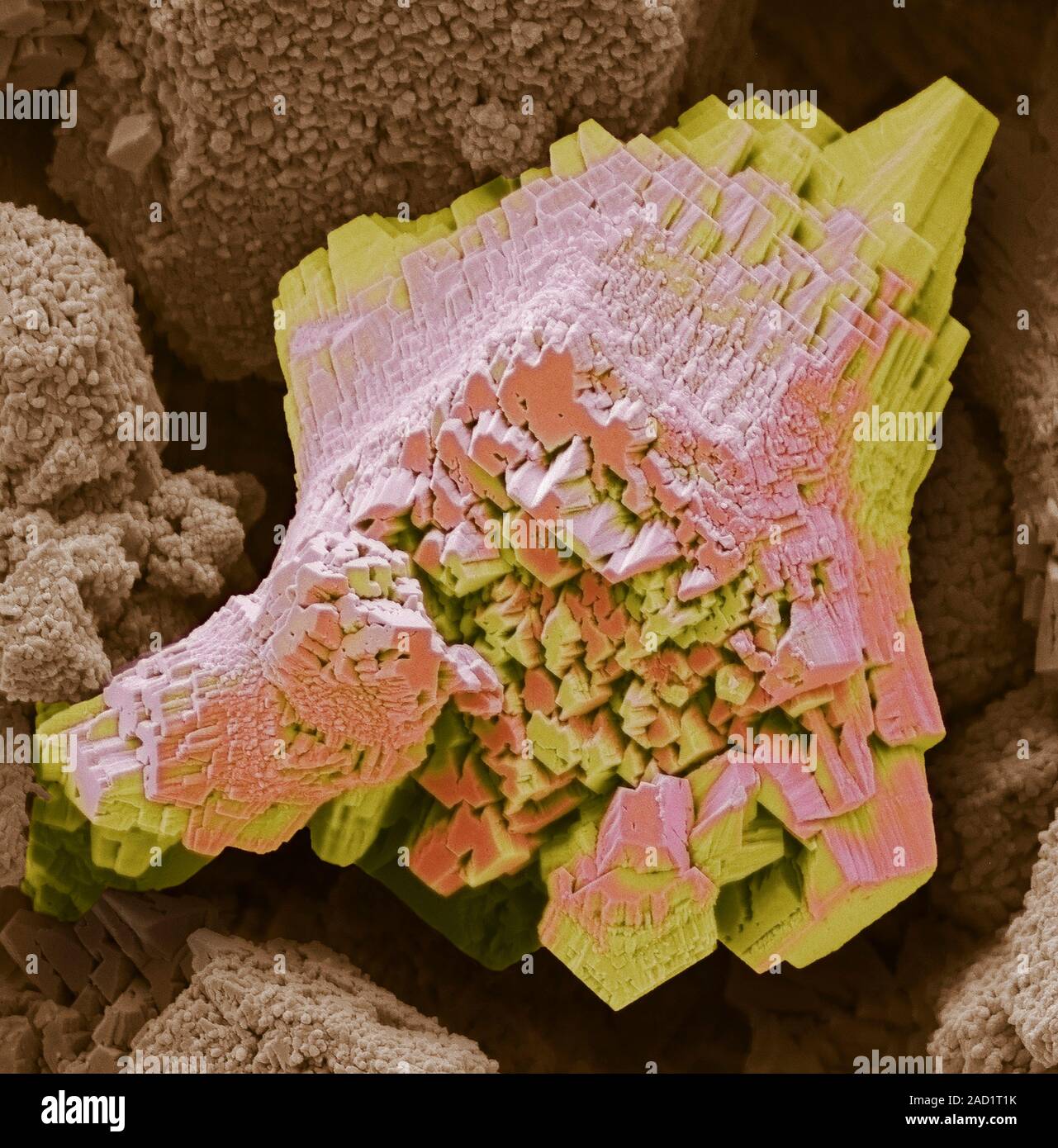 Limescale. Coloured scanning electron micrograph (SEM) of limescale ...
