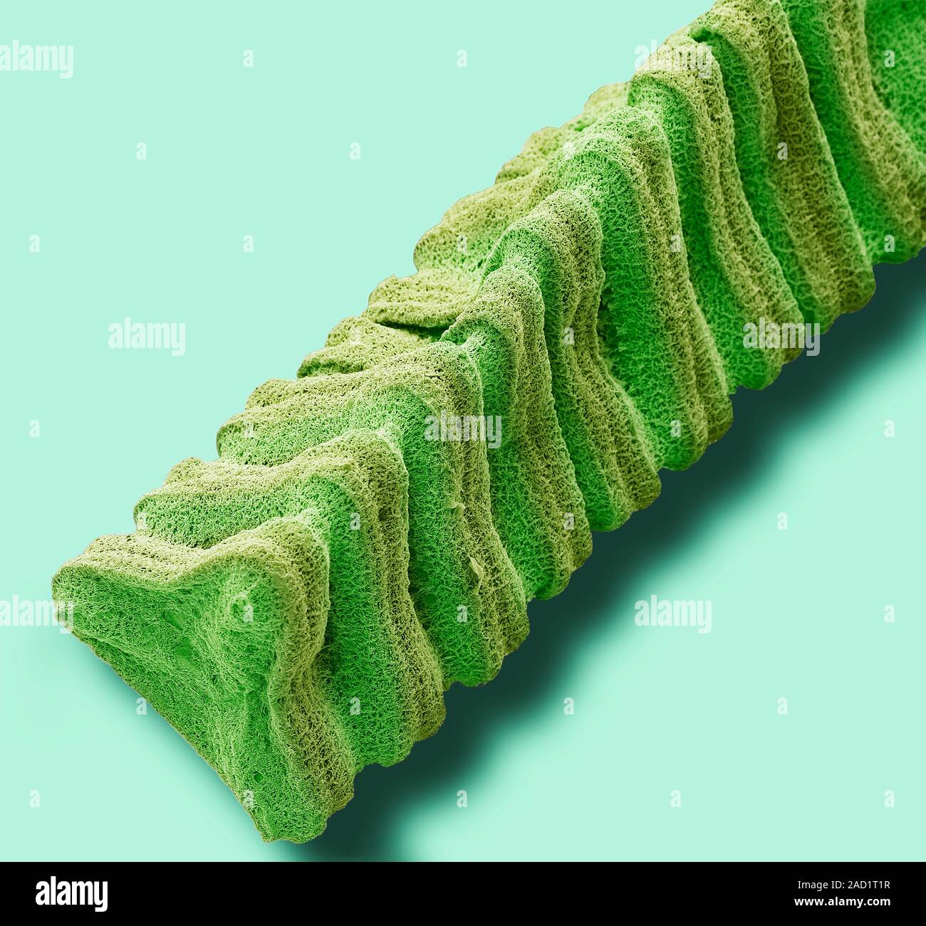 Desmidium desmid. Scanning electron micrograph (SEM) of a Desmidium ...