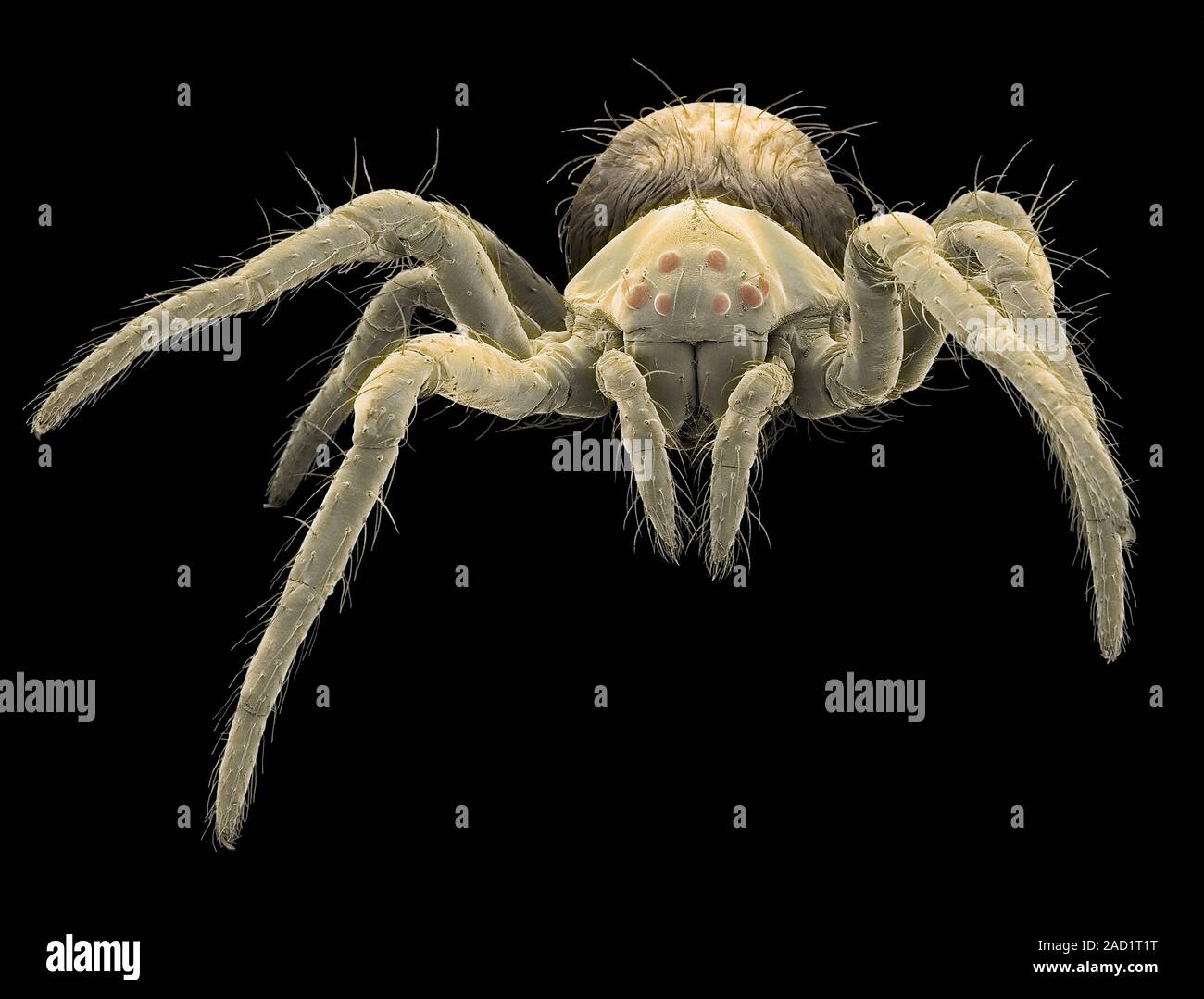 European garden spiderling. Coloured scanning electron micrograph (SEM ...