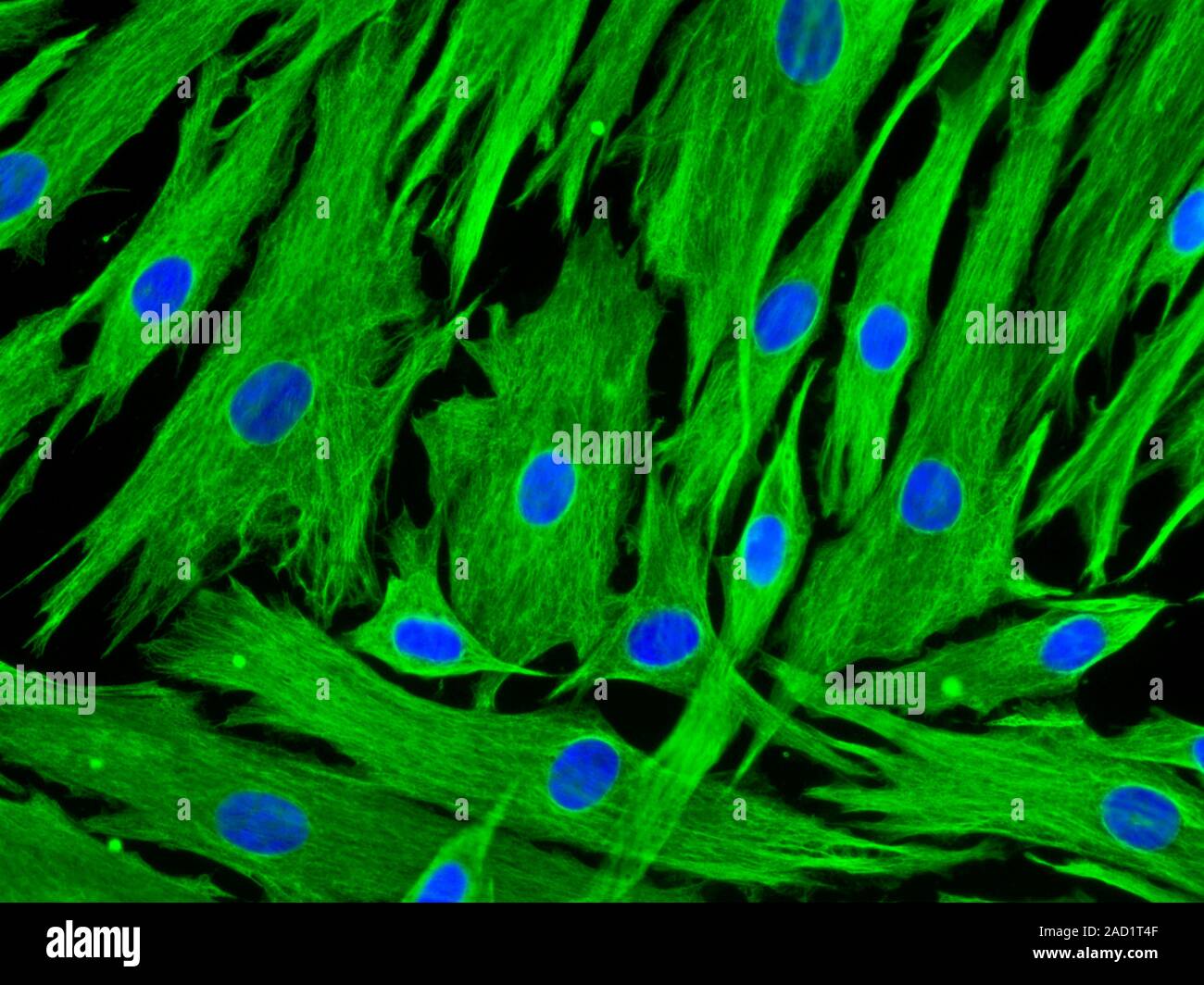Hair follicle cells. Fluorescence light micrograph of dermal papilla ...