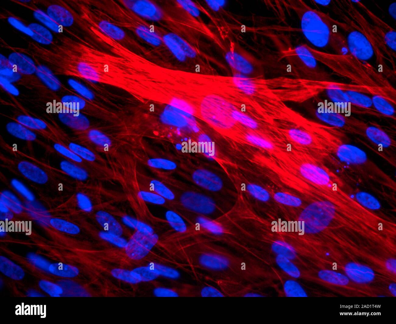 Skeletal muscle cells, fluorescence light micrograph. This muscle type ...