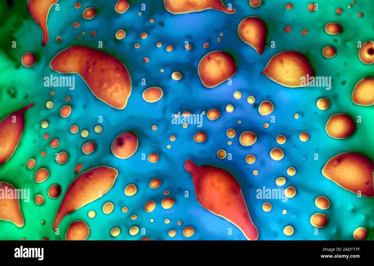 Iris pollen. Coloured backscattered scanning electron micrograph (SEM ...