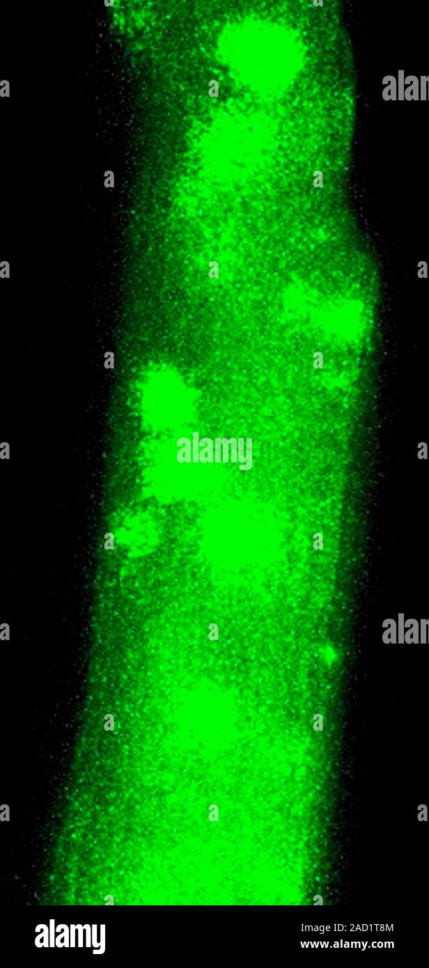 Heart muscle calcium sparks. Fluorescence deconvolution light ...