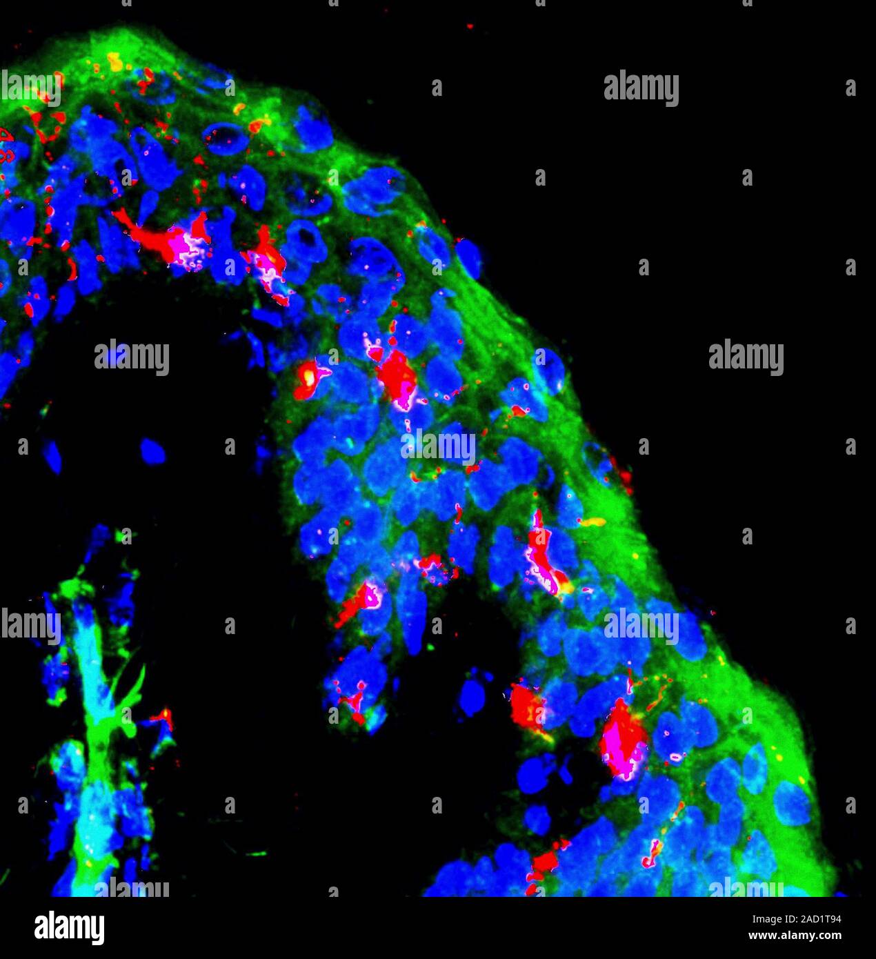Dendritic immune cells. Fluorescent deconvolution light micrograph of a ...