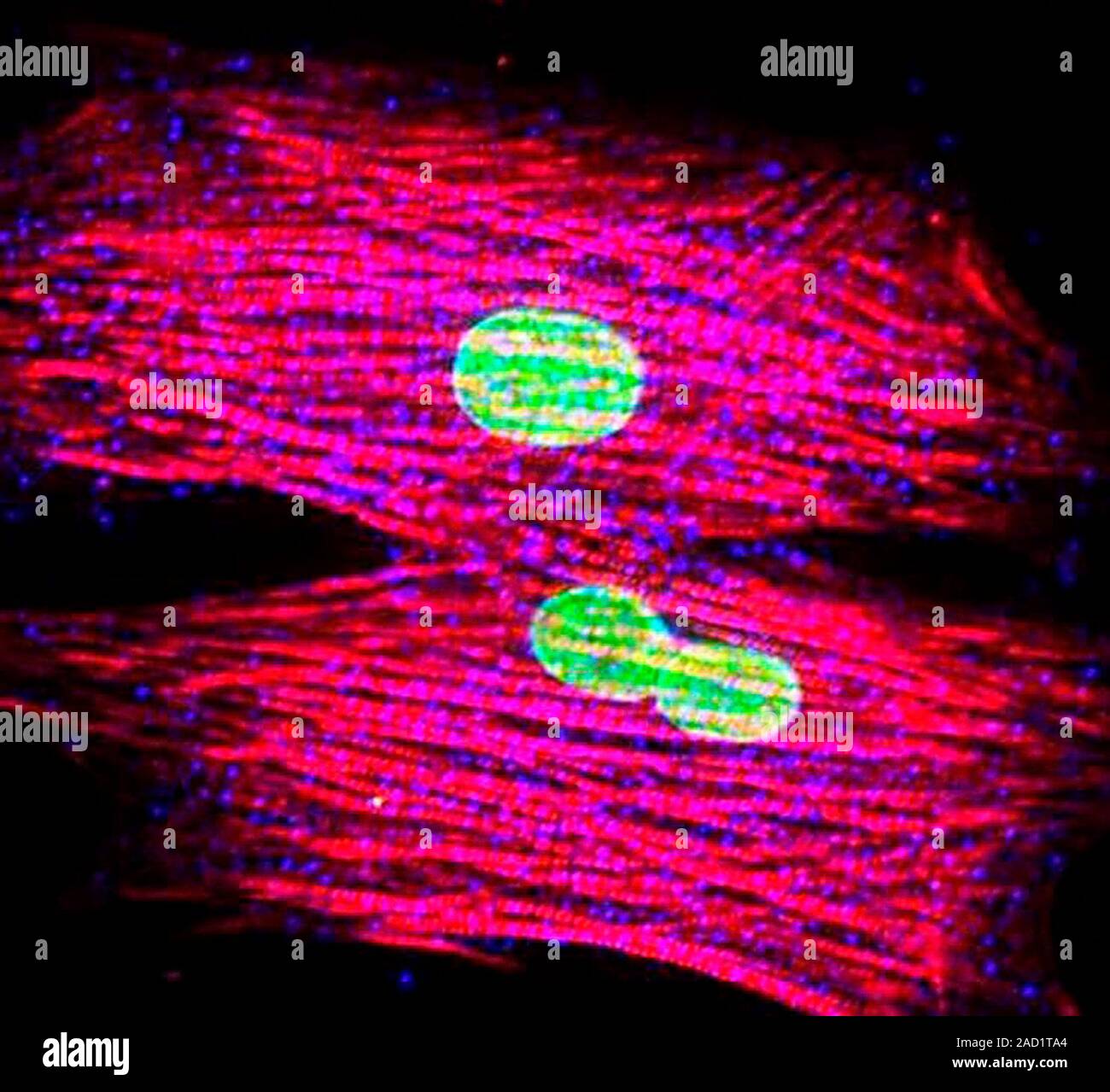 Heart muscle cells. Fluorescence deconvolution light micrograph of a ...
