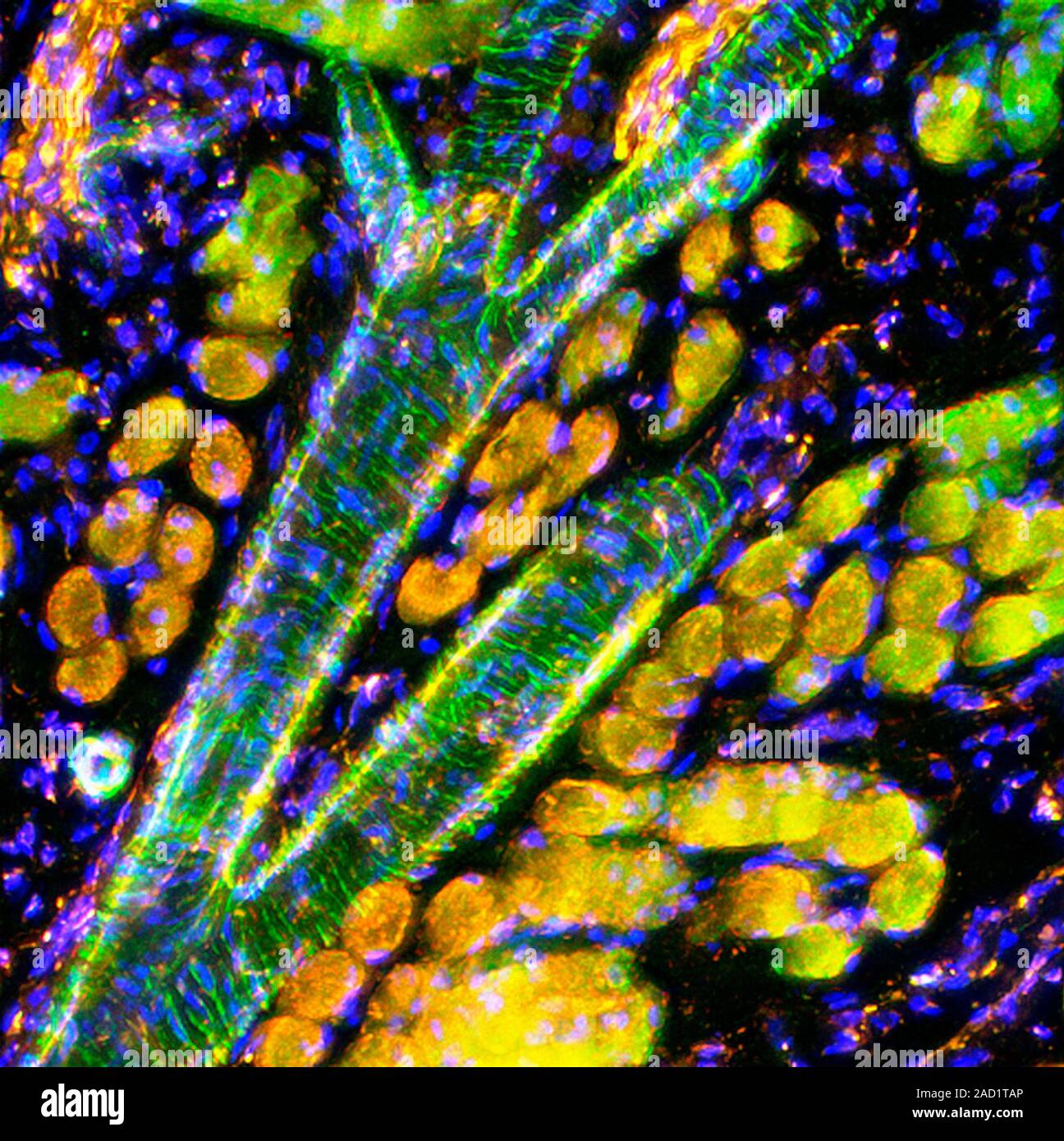 Branching blood vessel. Fluorescence deconvolution light micrograph of ...