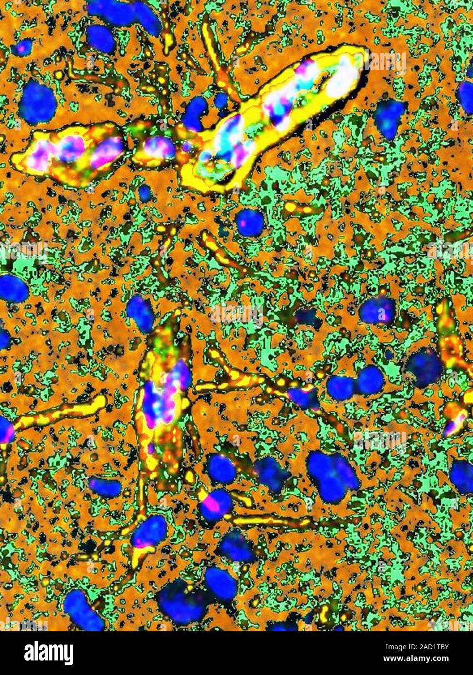 Brain blood vessels. Fluorescence deconvolution light micrograph of a ...