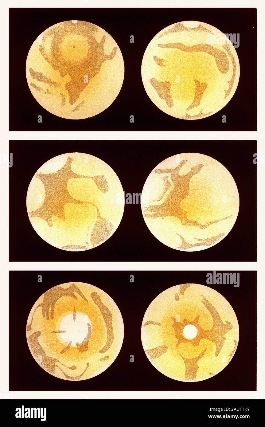 Mars, historical illustration. Collection of drawings made before 1850 ...