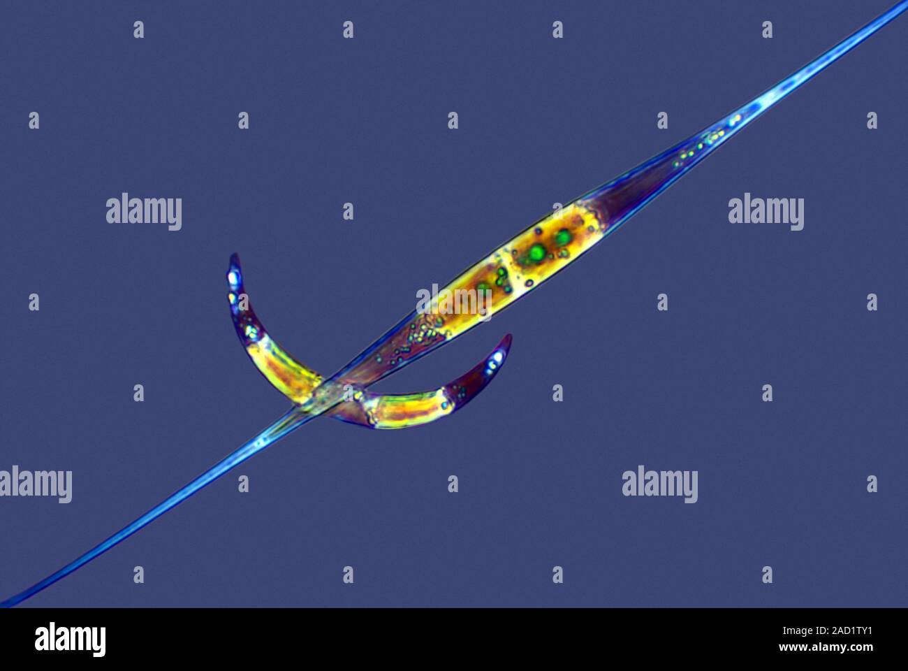 Closterium desmids. Polarised light micrograph of Closterium sp ...