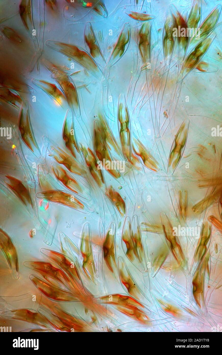 Cymbella diatoms. Polarised light micrograph of Cymbella sp. diatoms ...