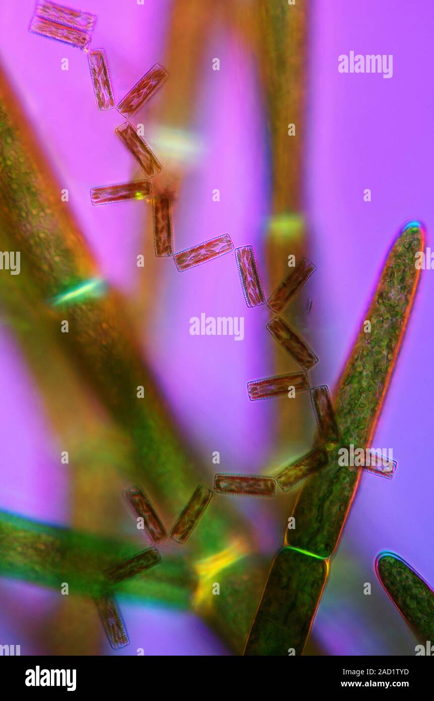 Diatoms. Polarised light micrograph of Diatoma sp. (rectangular) and ...