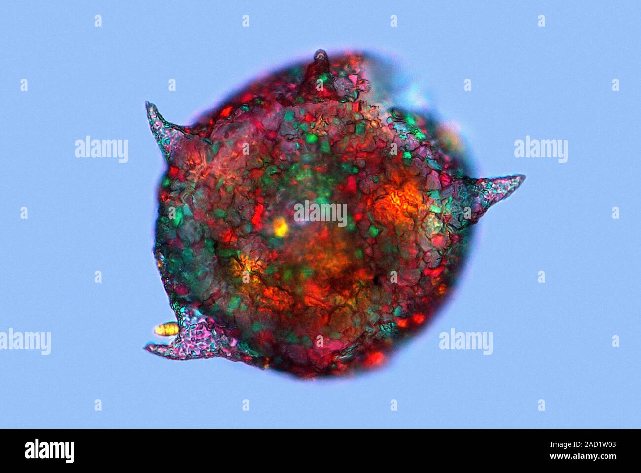 Shelled amoeba. Polarised light micrograph of an Arcella sp. testate ...