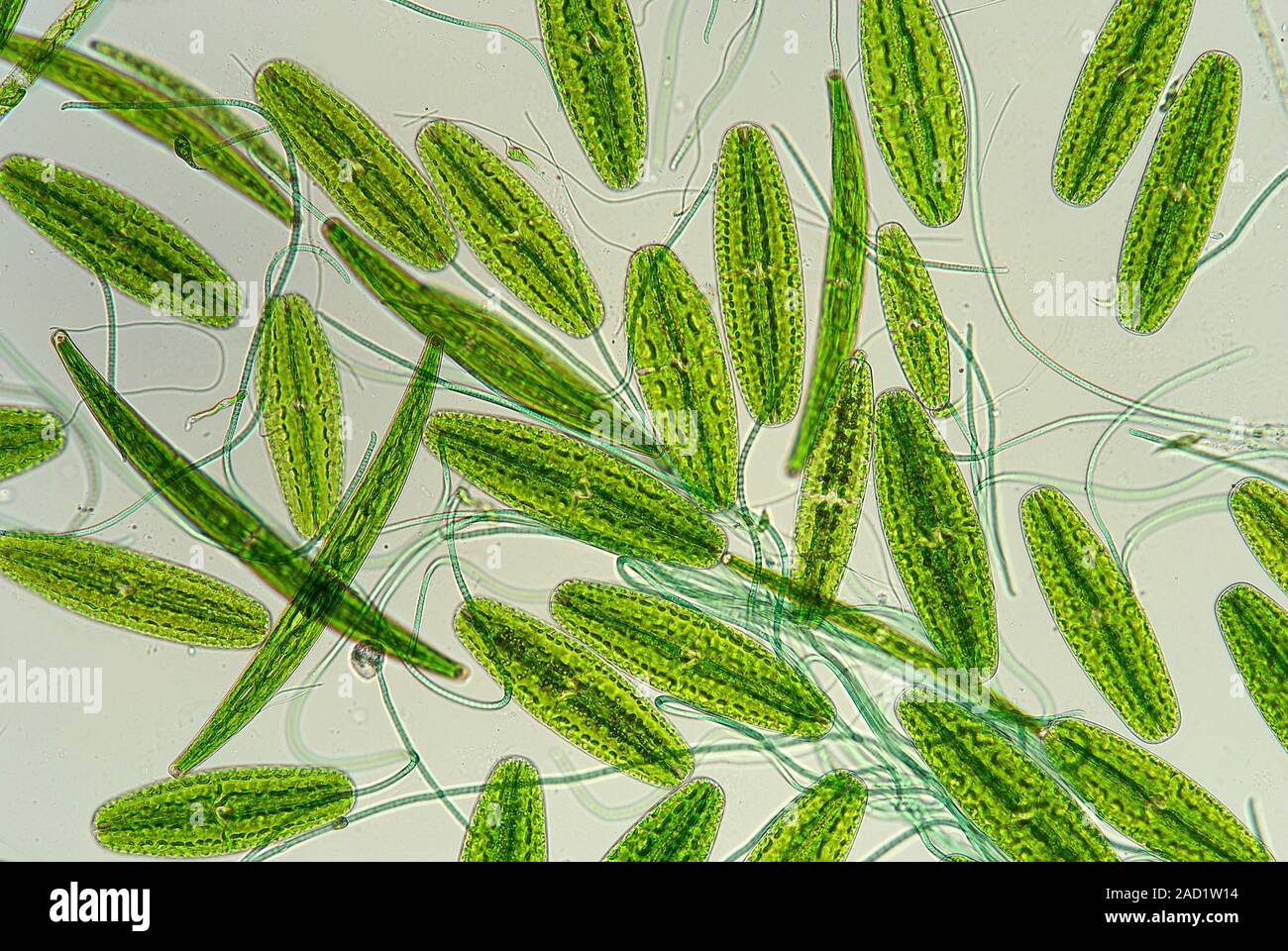 Desmids and cyanobacteria. Polarised light micrograph of Netrium sp ...