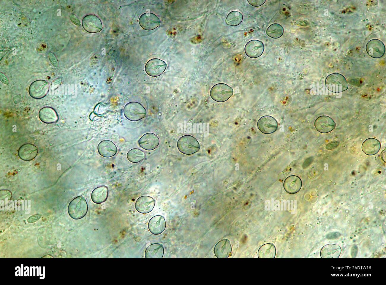 Hydra stinging cells. Brightfield illuminated light micrograph of a ...