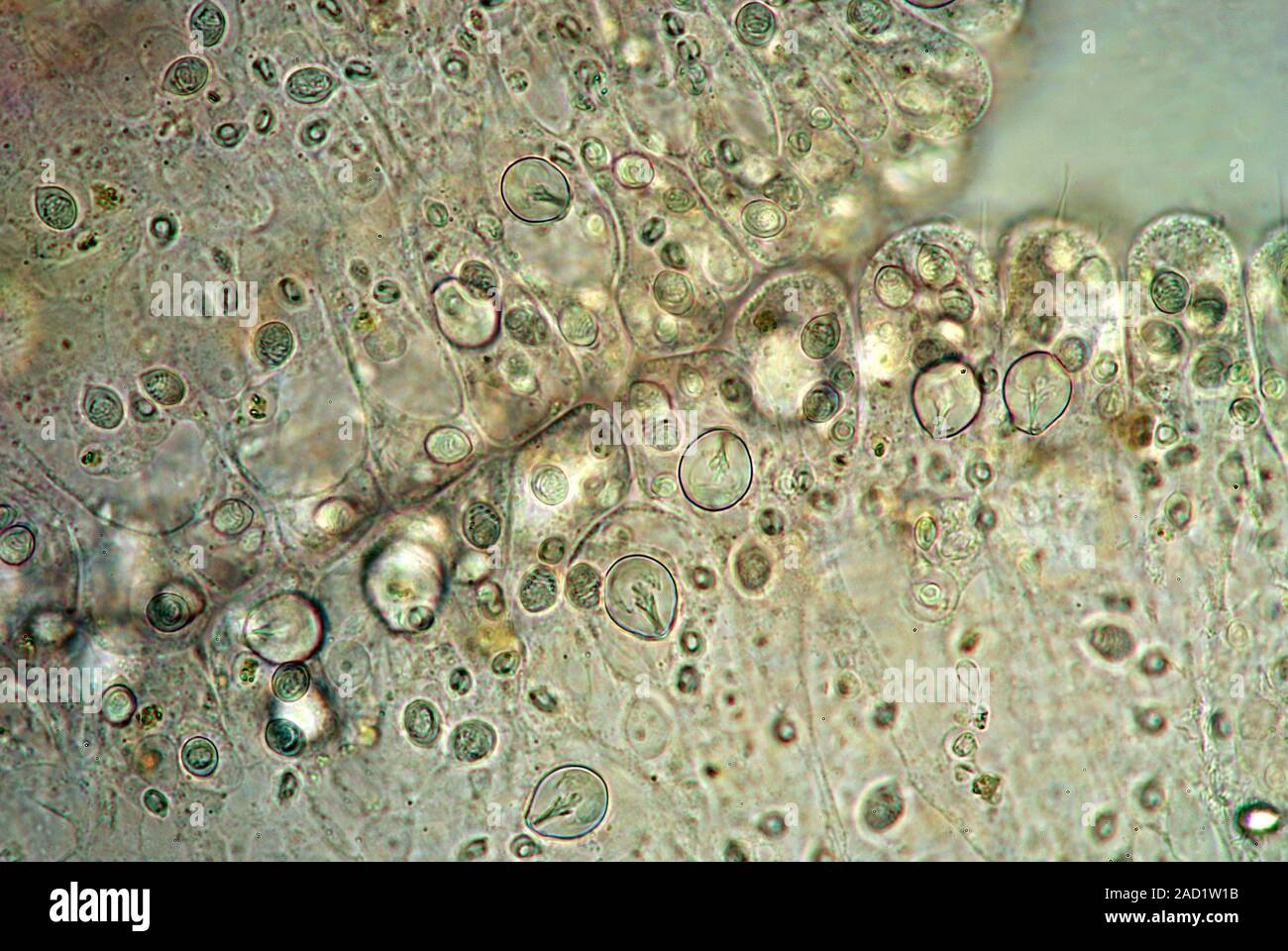 Hydra tentacle. Brightfield illuminated light micrograph of a section ...