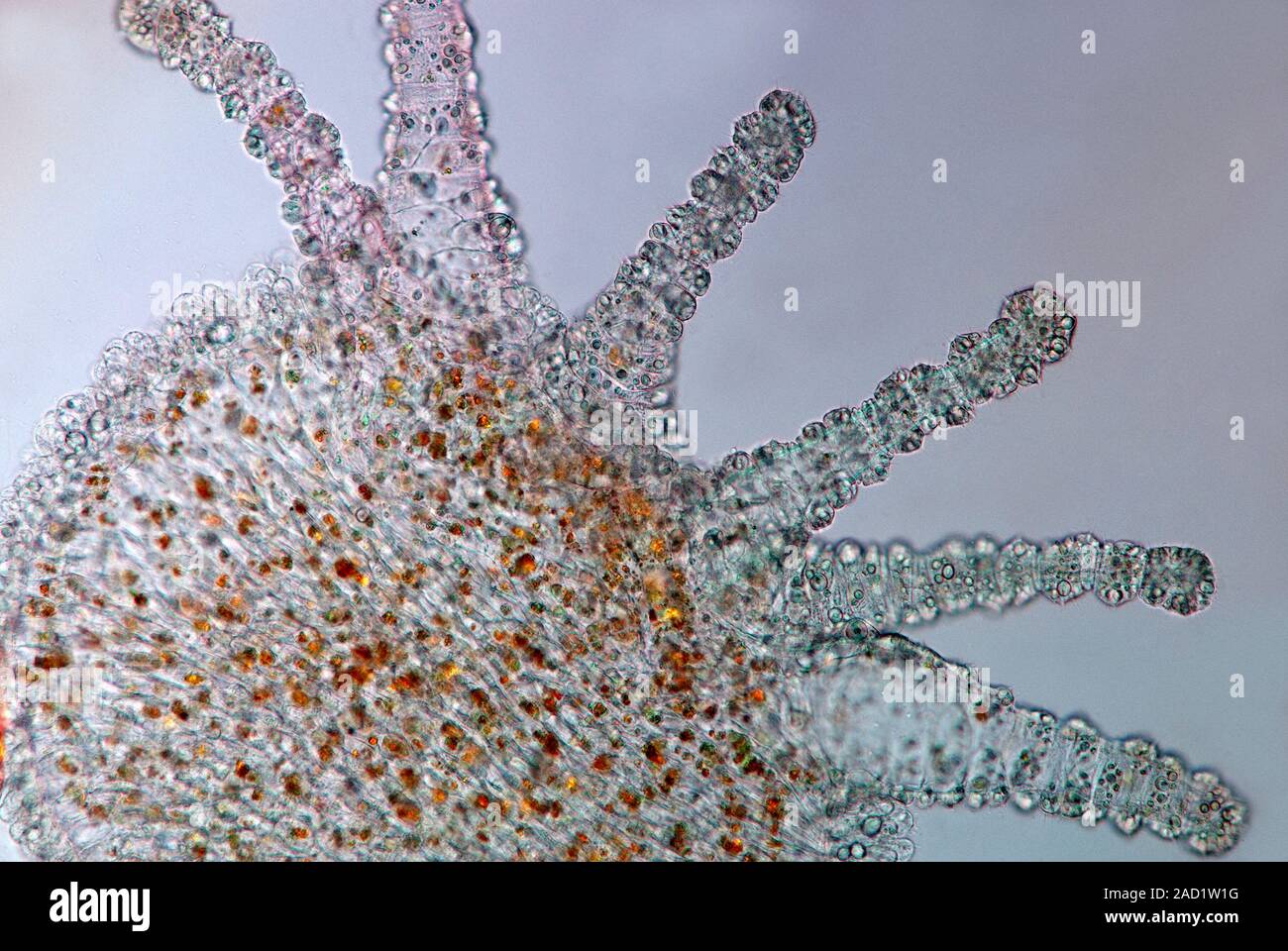 Hydra. Polarised light micrograph of a section through a hydra, showing ...